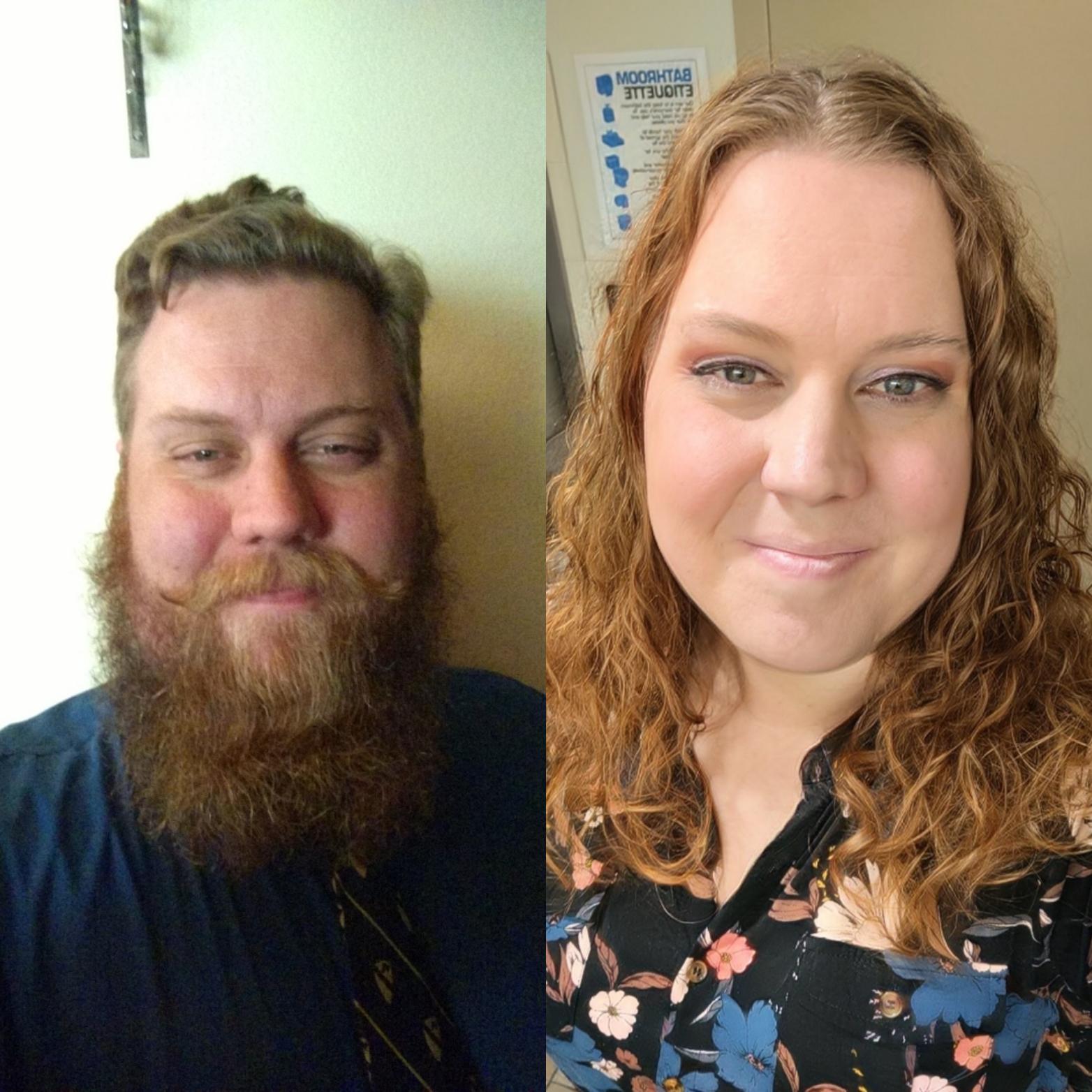 30 vs 36. 2.5 years HRT | Scrolller