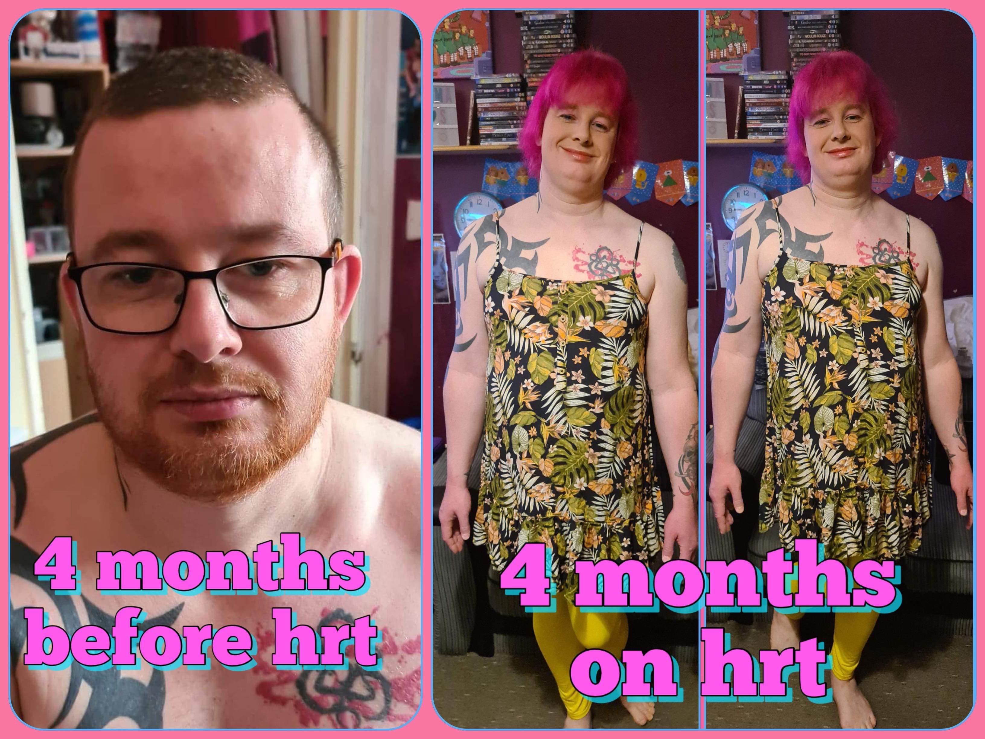 4 Months before HRT Vs. 4 months on HRT, whatdo you think? | Scrolller
