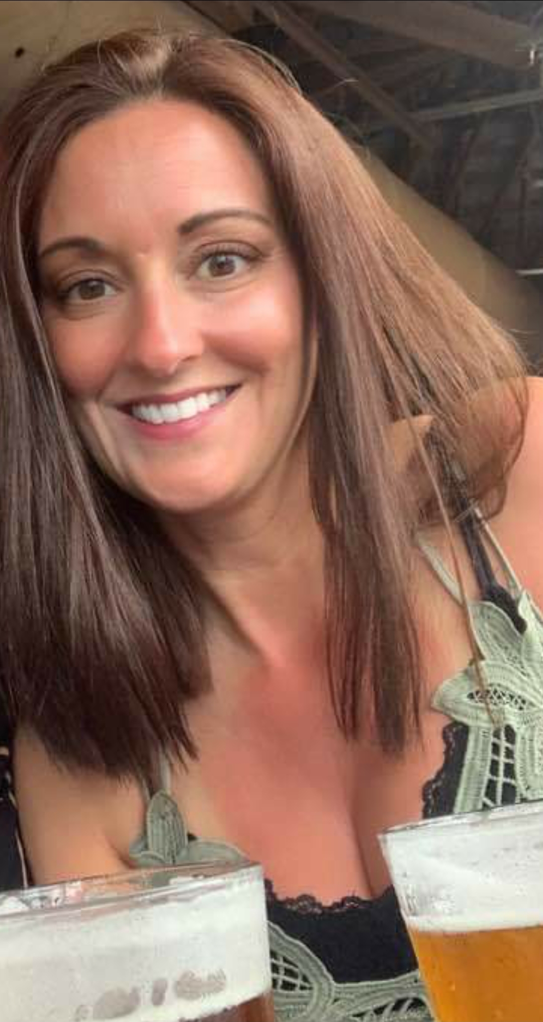 44F sunburn! | Scrolller