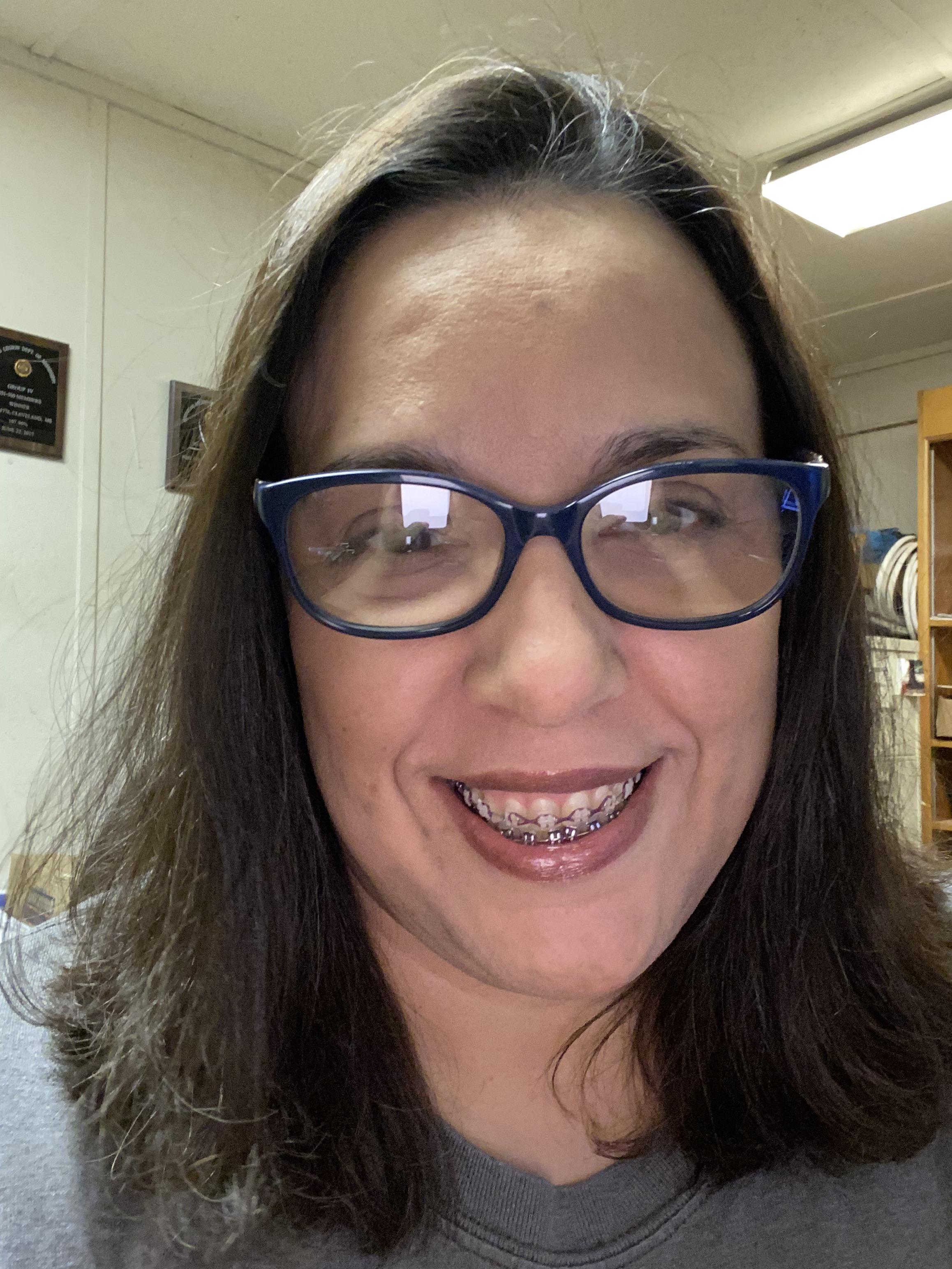 52 years old and got my braces in January. I am finally get a little smile confidence! | Scrolller