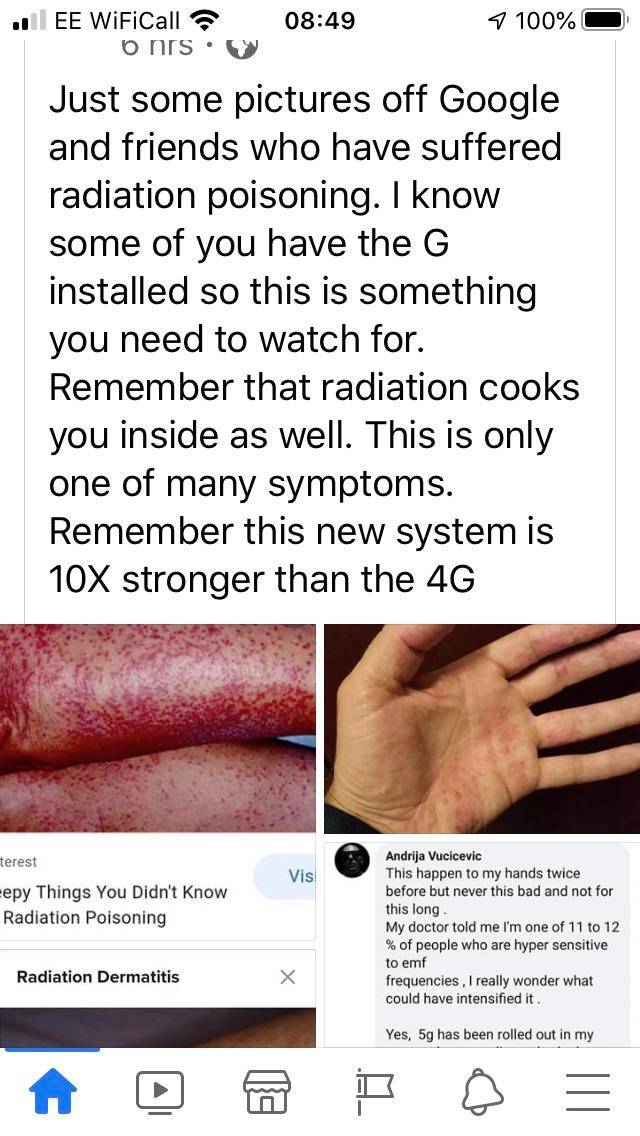 5G CauSes cOroNa | Scrolller