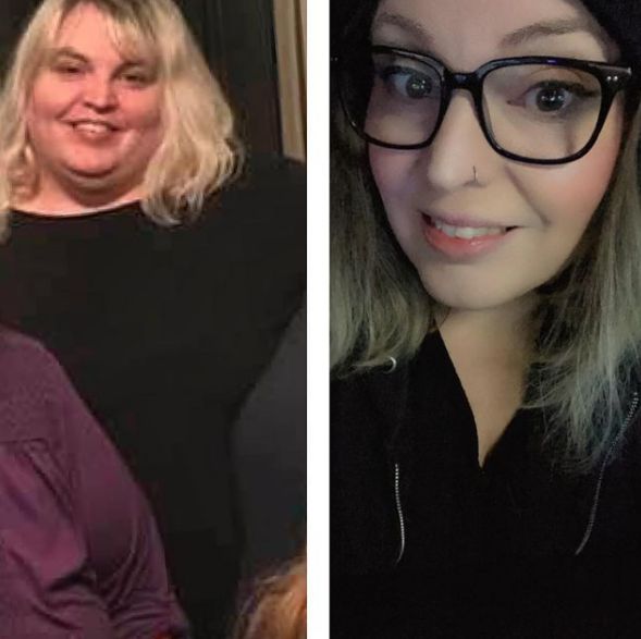 6 Months Post-Op Face Gains! | Scrolller