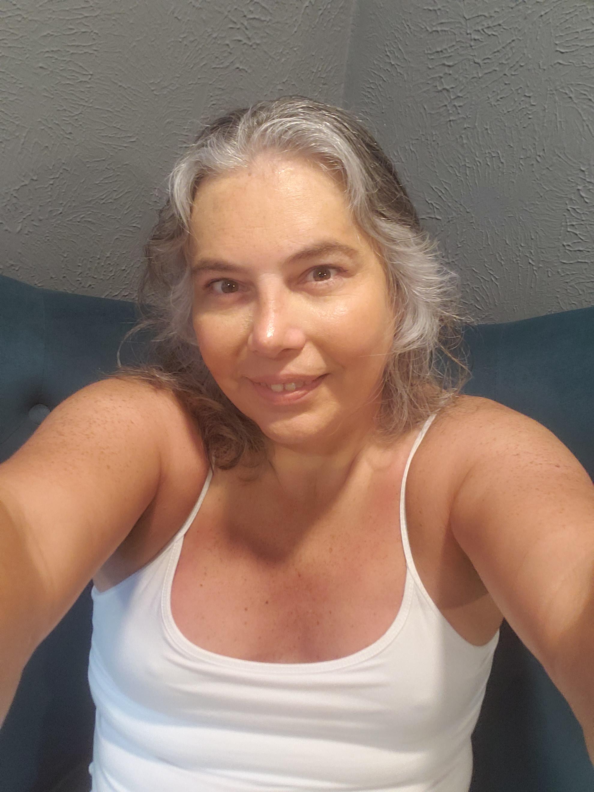 6 weeks after FFS | Scrolller