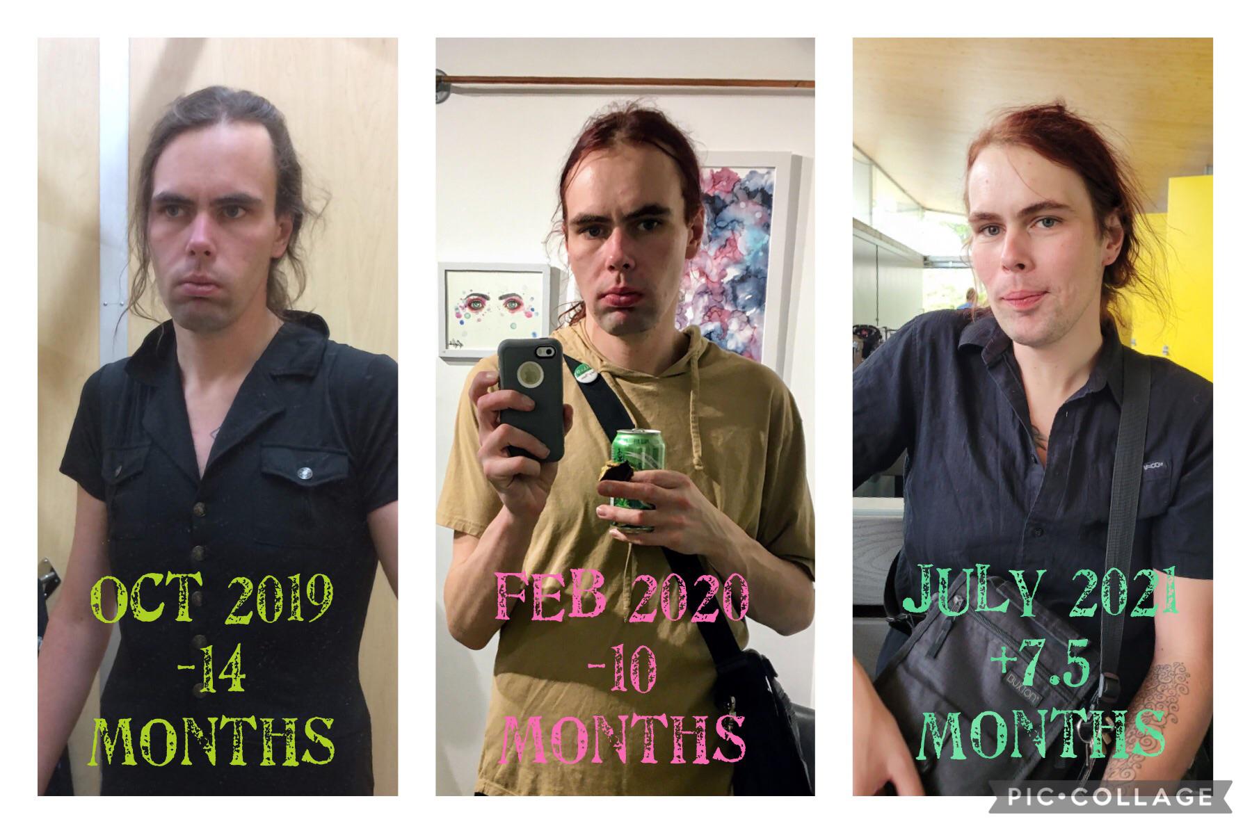 7.5 months hrt, butch / masc mtf. | Scrolller
