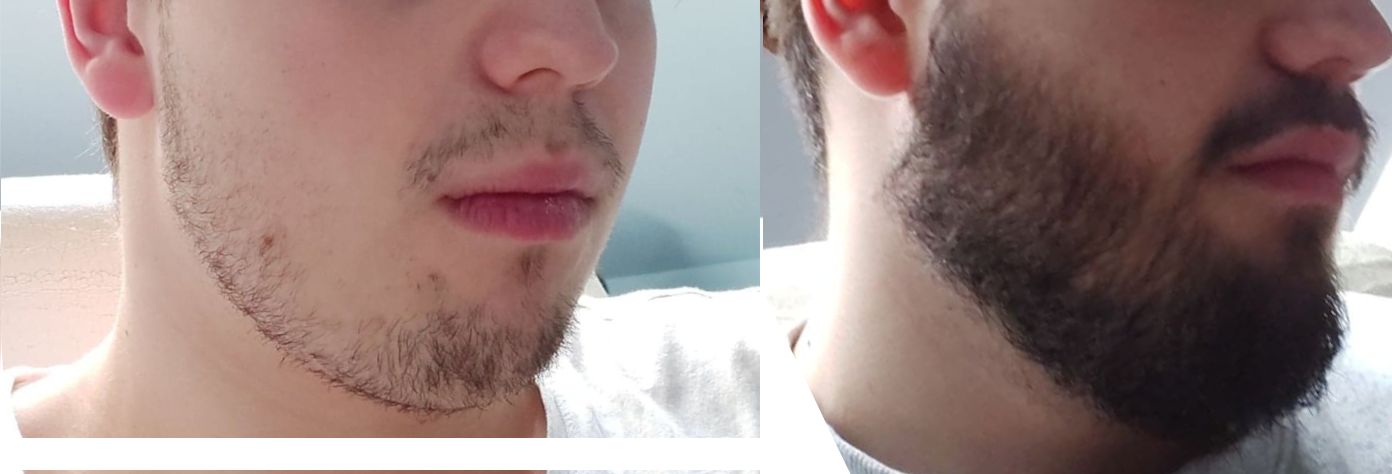 7 months | Scrolller