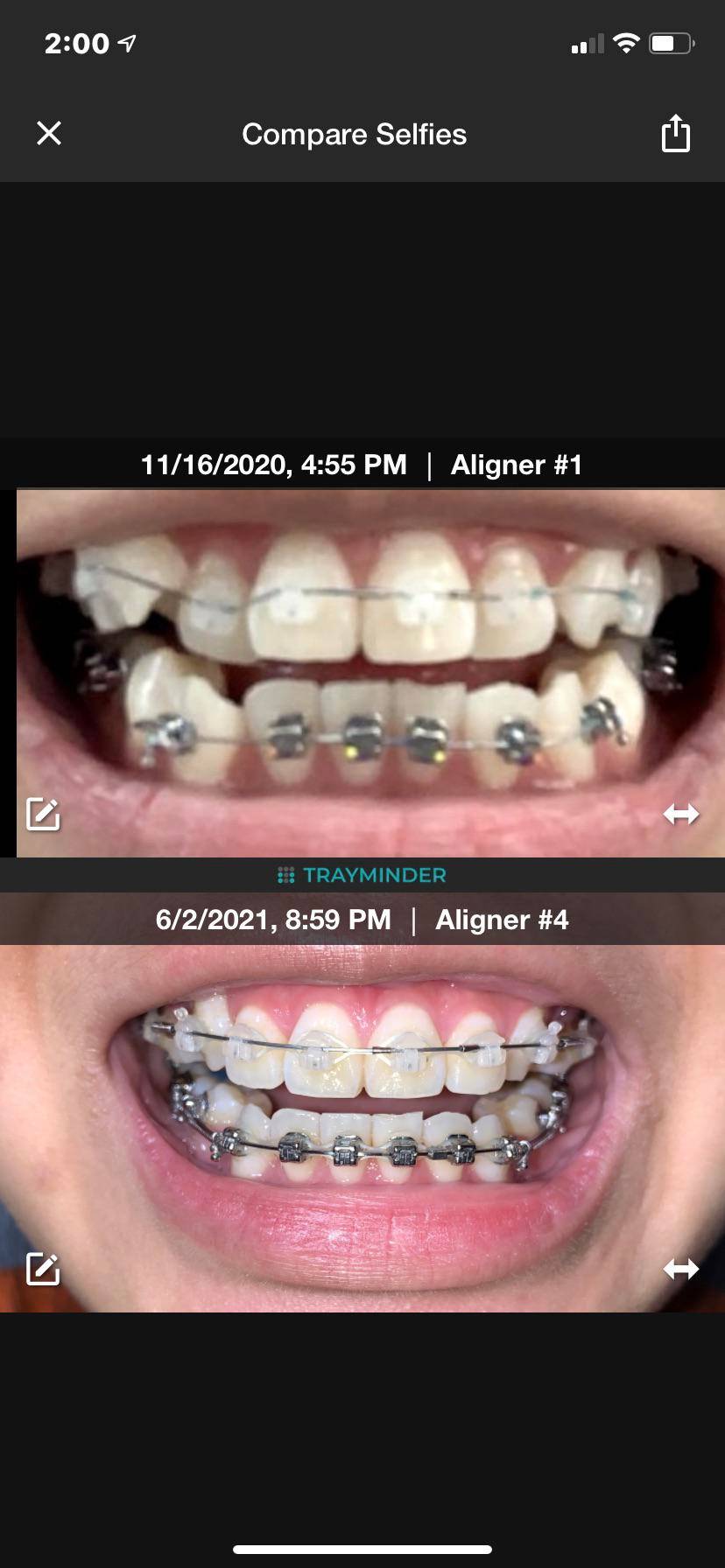7 months progress! | Scrolller