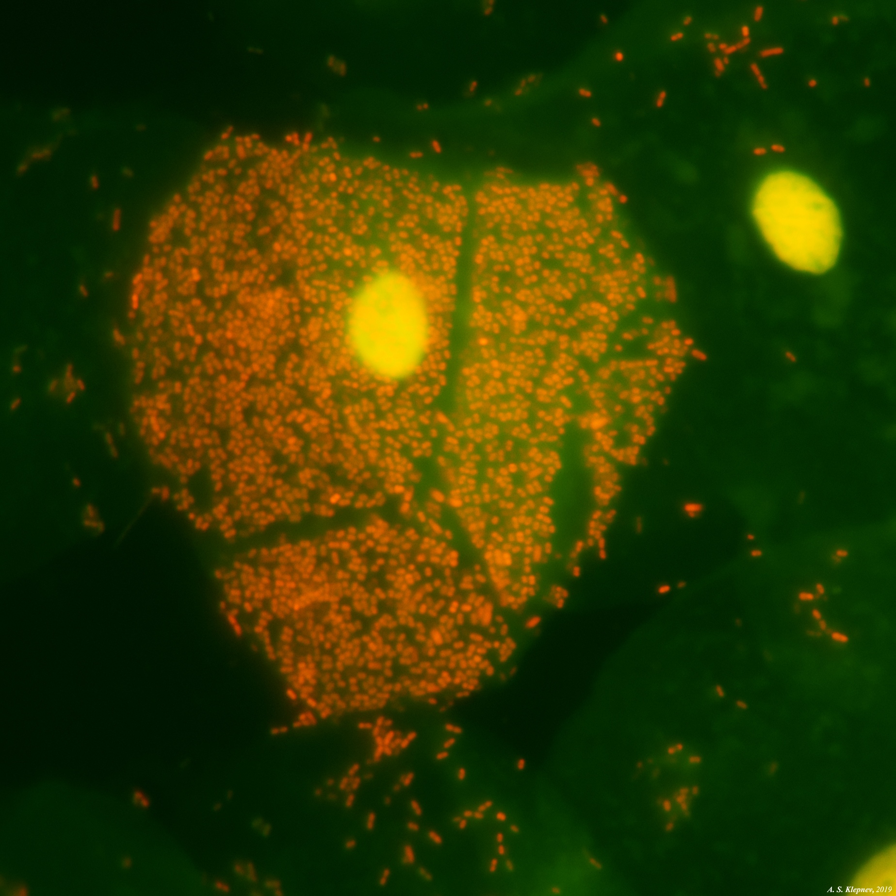A buccal epithelial cell coated with bacteria. Coloring acridine orange. Fluorescence | Scrolller