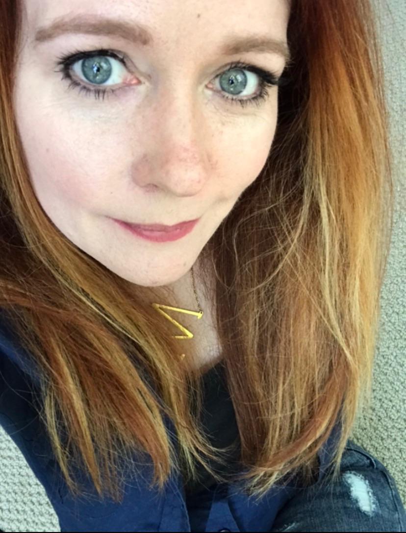 A Dusting of Freckles | Scrolller