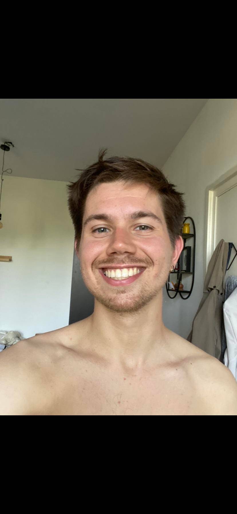 A Mild Sunburn 🌞😬 Scrolller