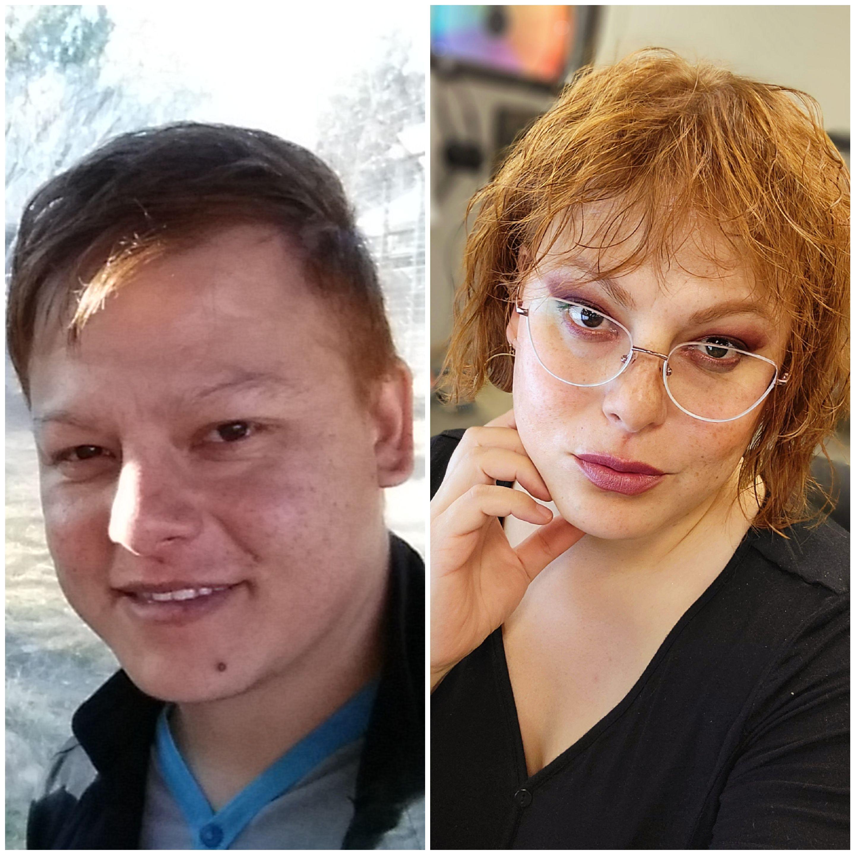 About a 7 year difference in these pictures. 42 years old now and 4 years into hrt. Things take ...