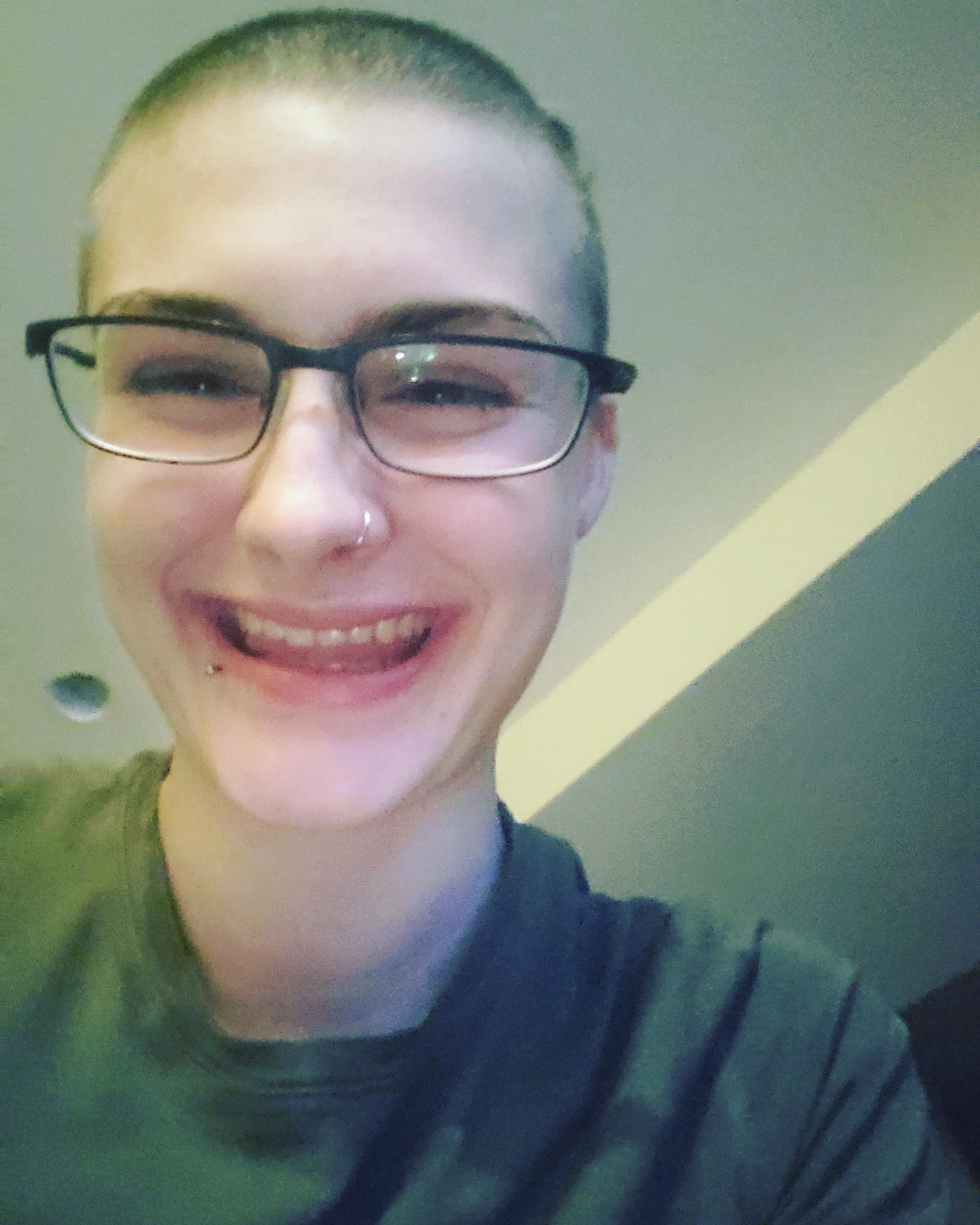 After 8 years of daily pulling, i shaved my head | Scrolller