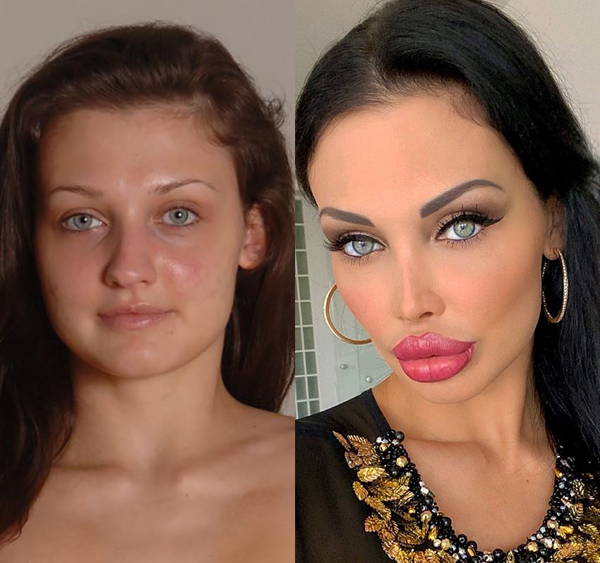 Before and Now | Scrolller