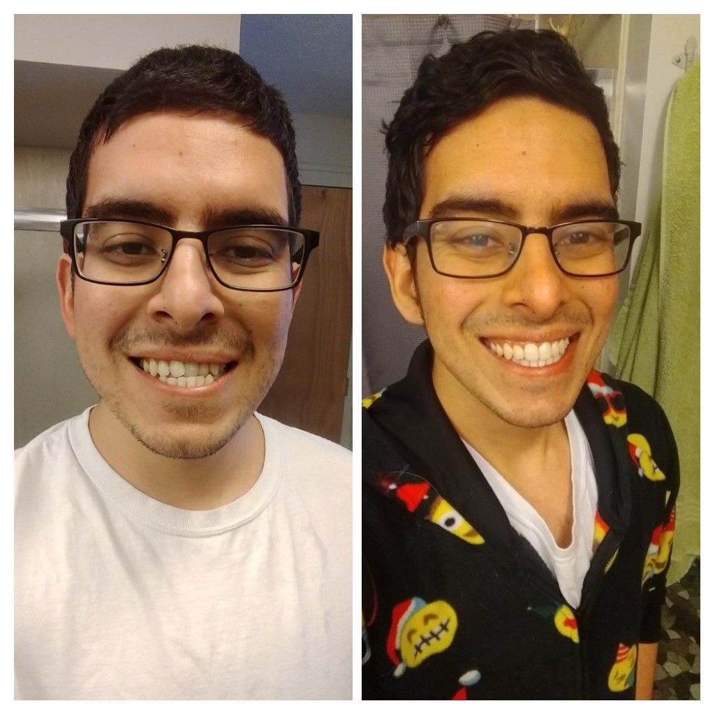 Almost at the finish line! | Scrolller