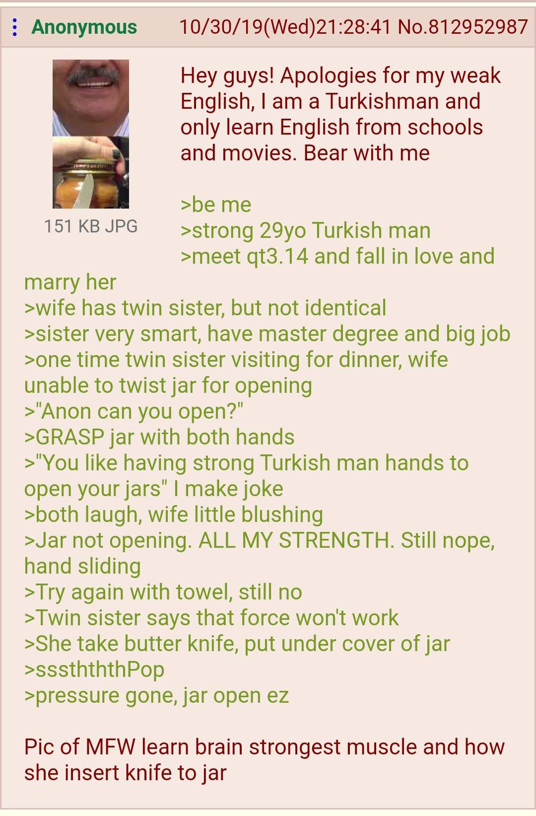 Anon is turkish | Scrolller