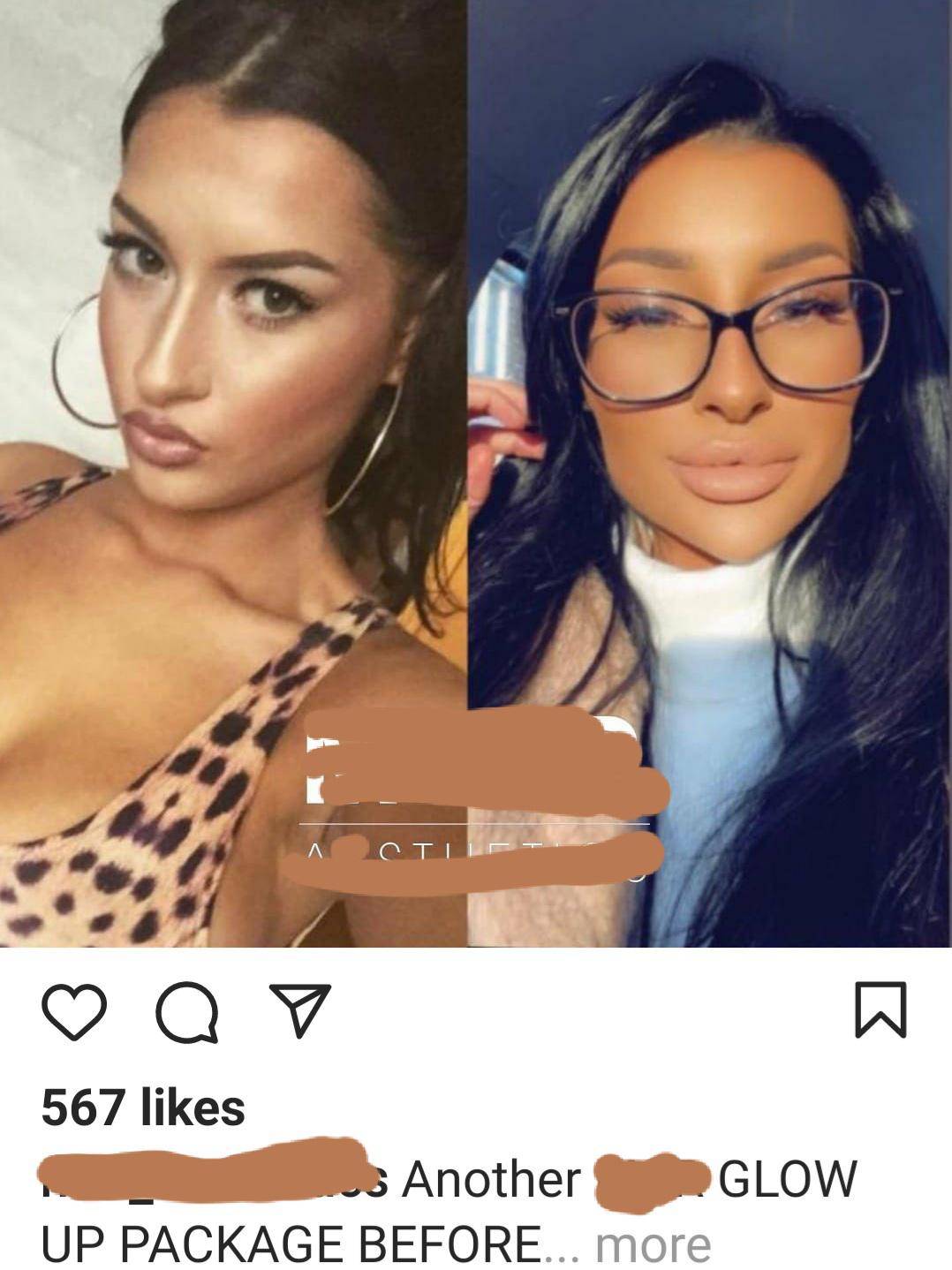 Another Glow up! | Scrolller