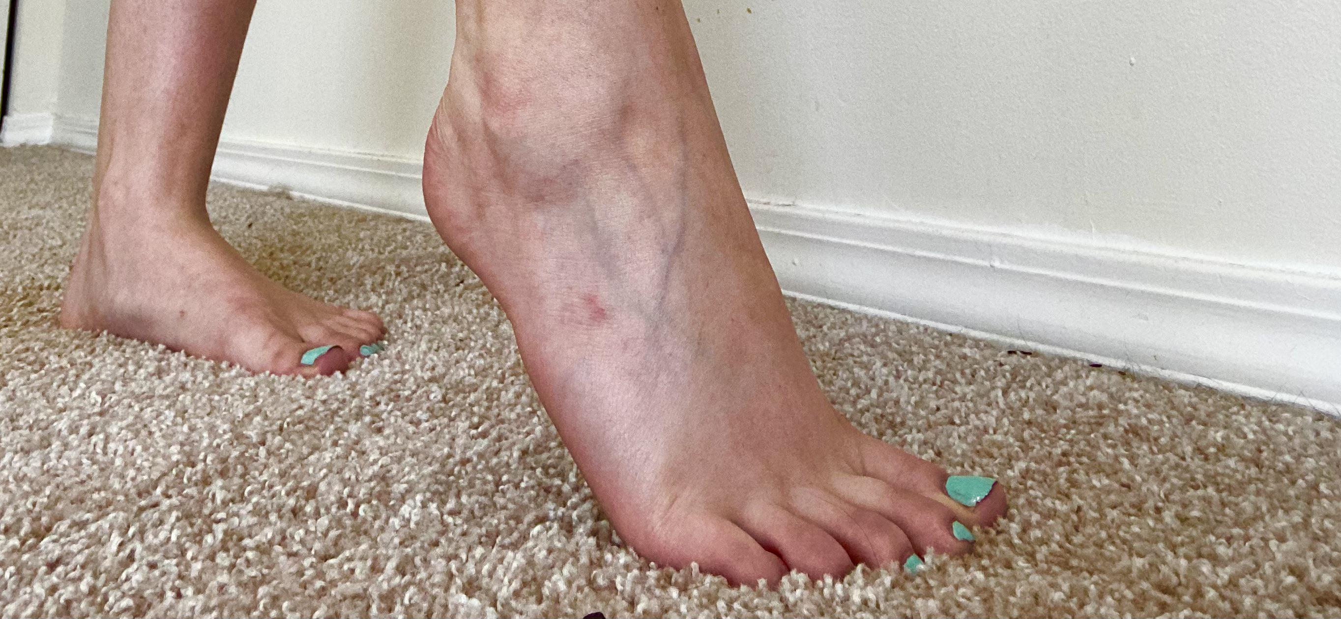 anyone into veins? | Scrolller