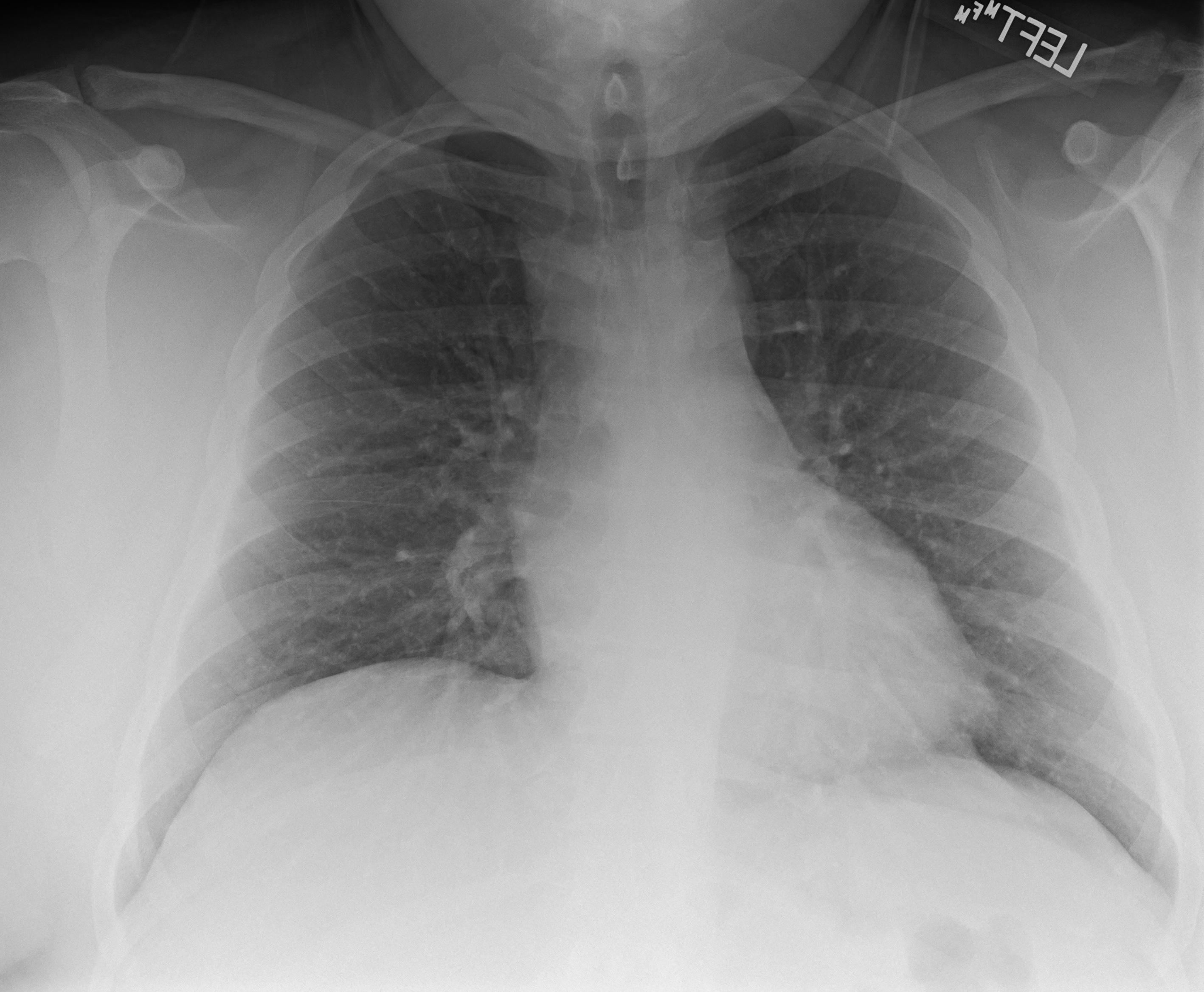 Are these healthy lungs? | Scrolller