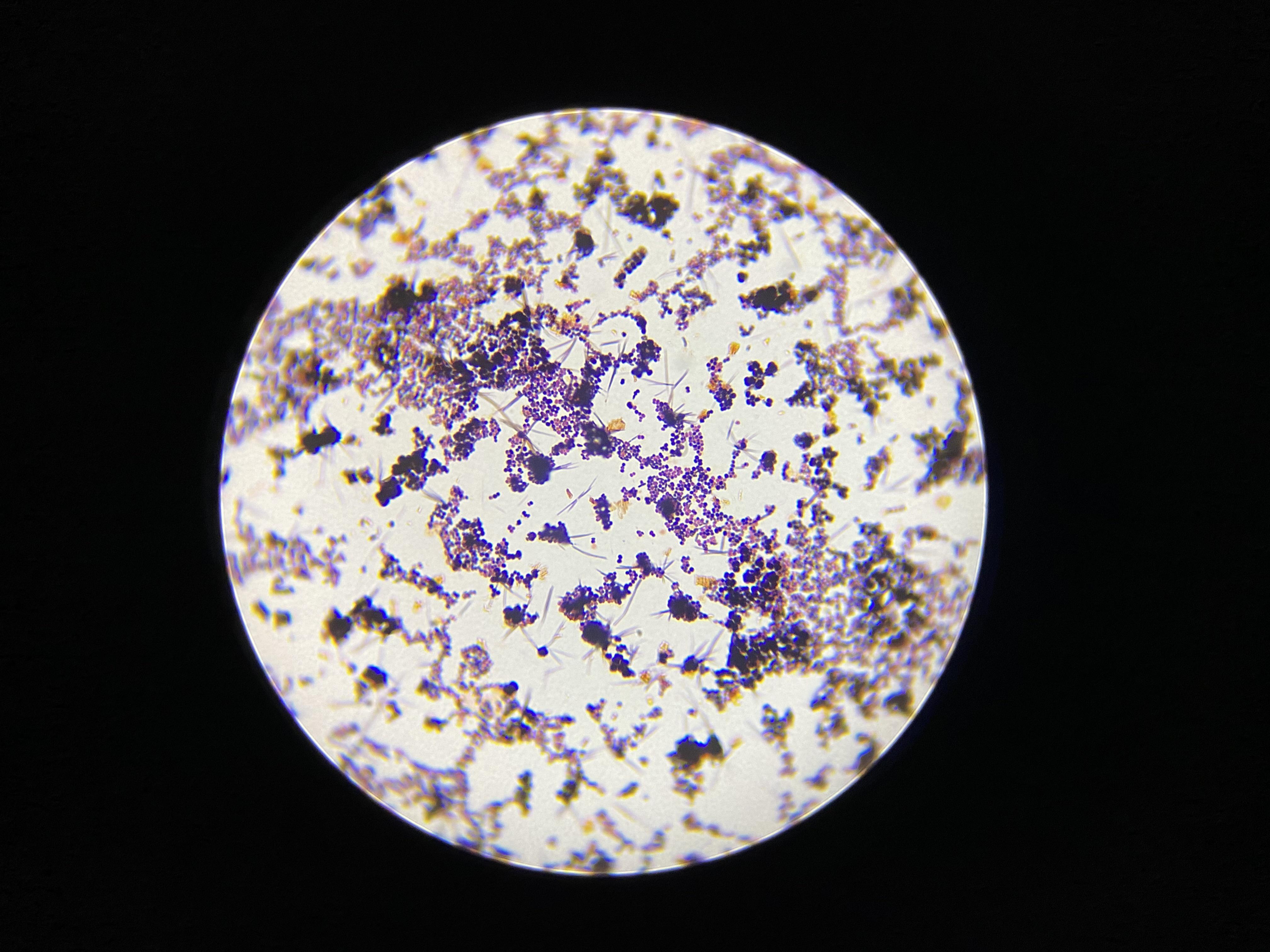 Bacteria i swabbed from my fingers for my micro class | Scrolller