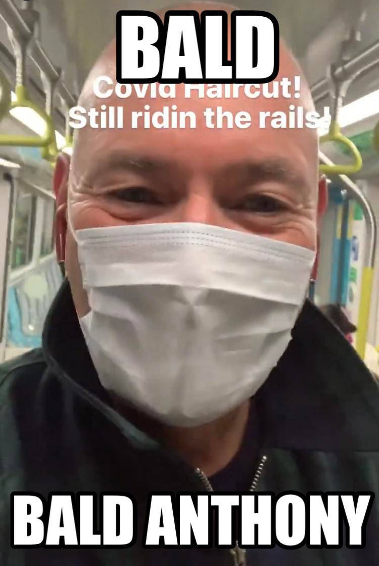 BALD ANTHONY | Scrolller