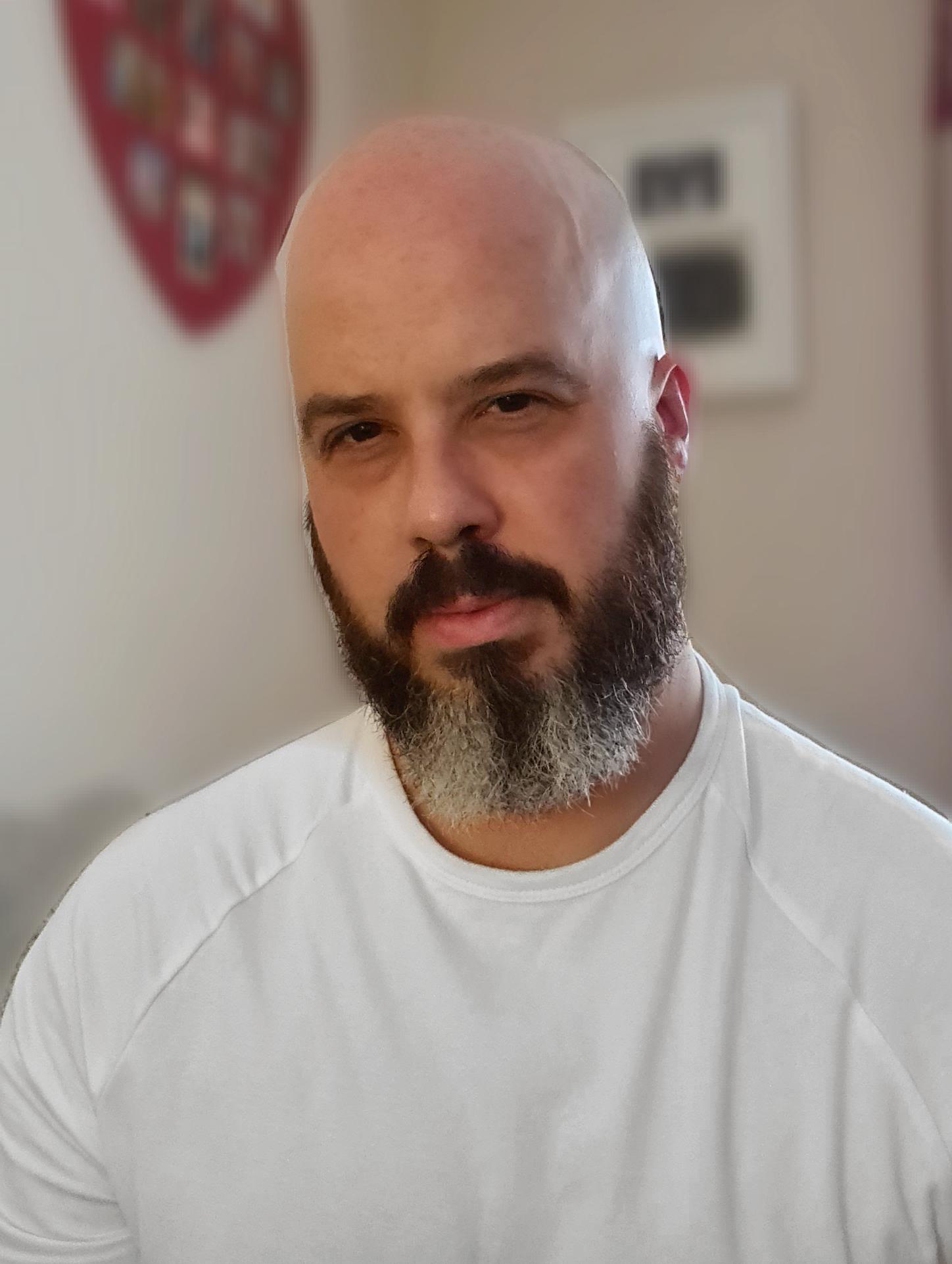 Bald? Get a beard! | Scrolller