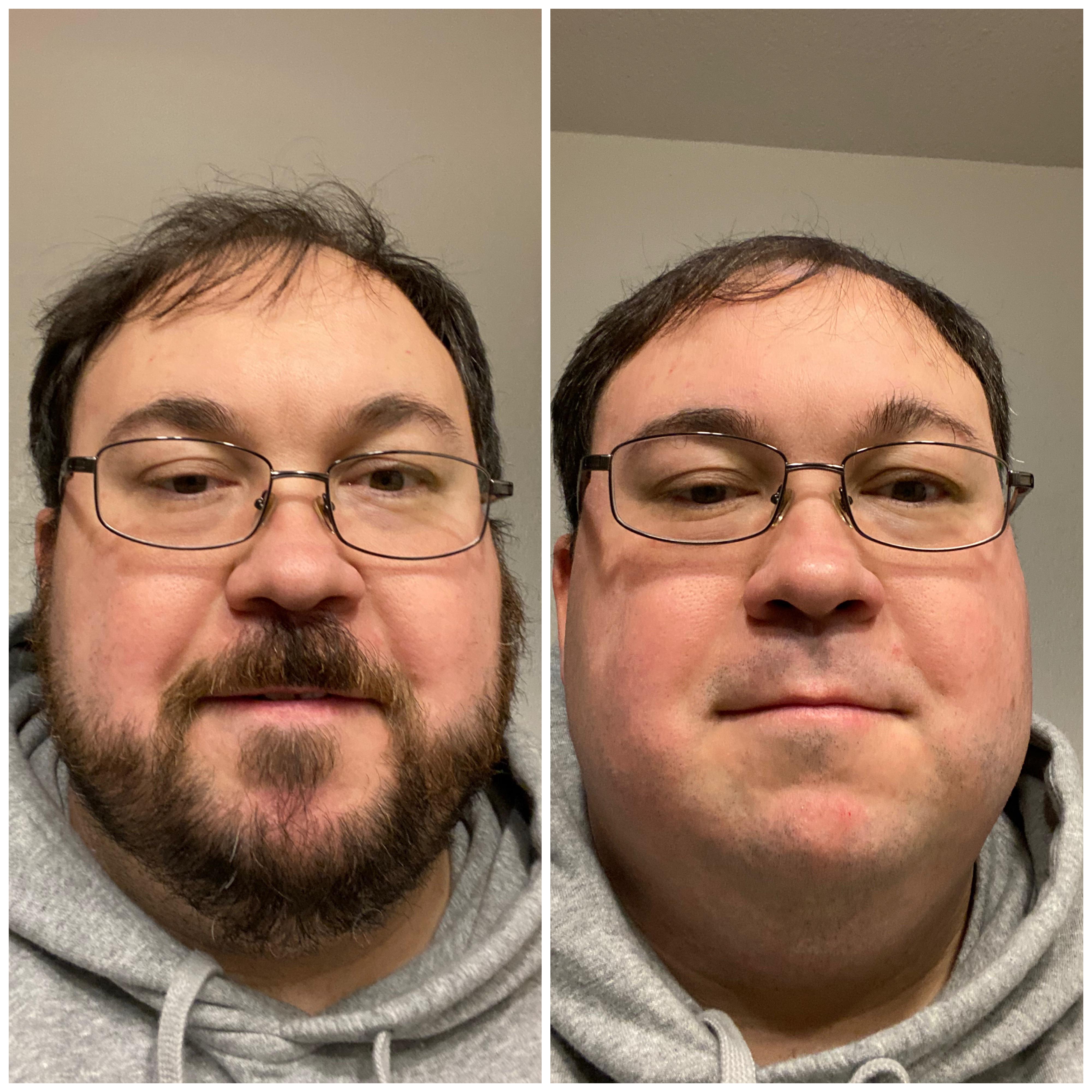 Beard or no beard? 🙃 | Scrolller