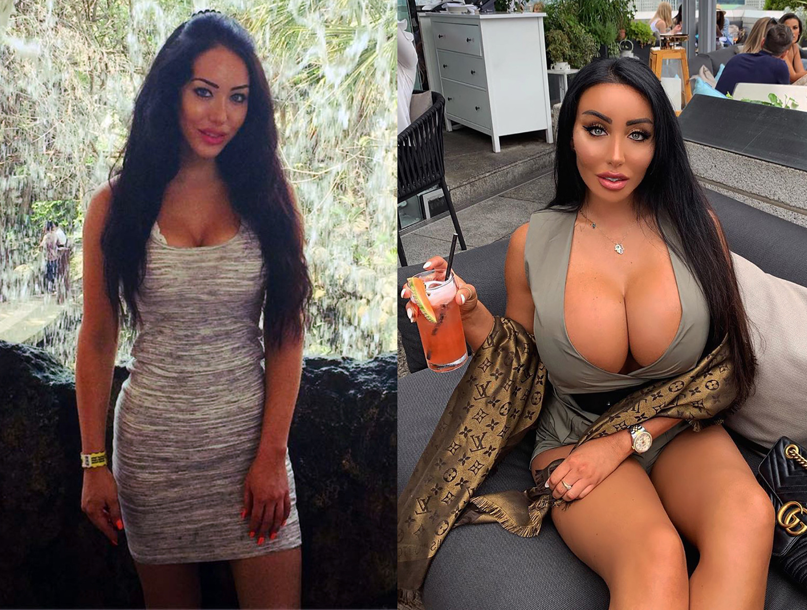 Before / After | Scrolller