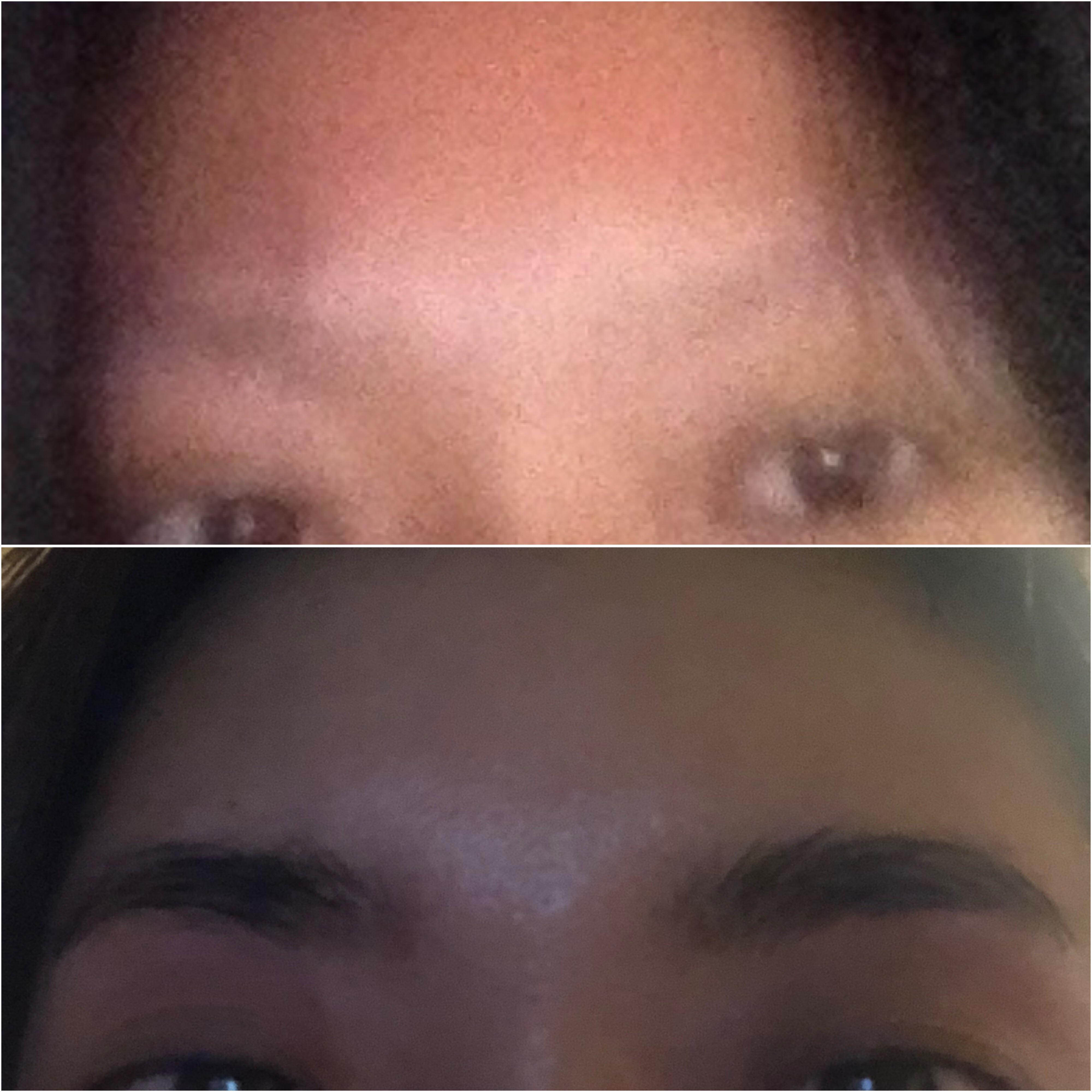 Before and after: my successful journey in growing my brows! (No ...