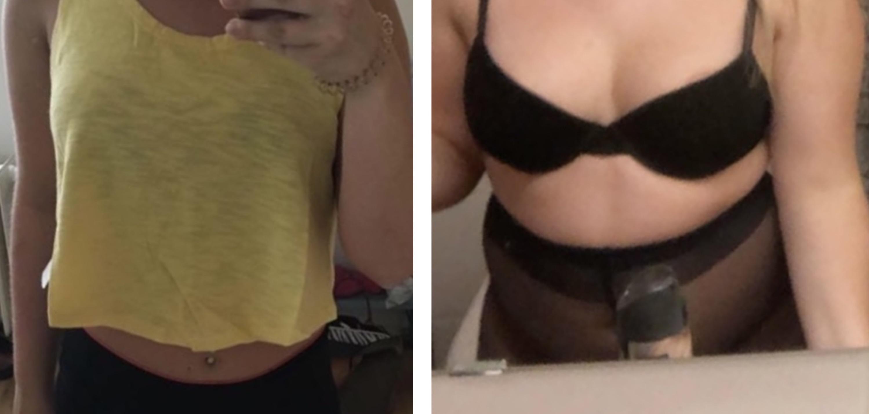 Blown up a little bit | Scrolller