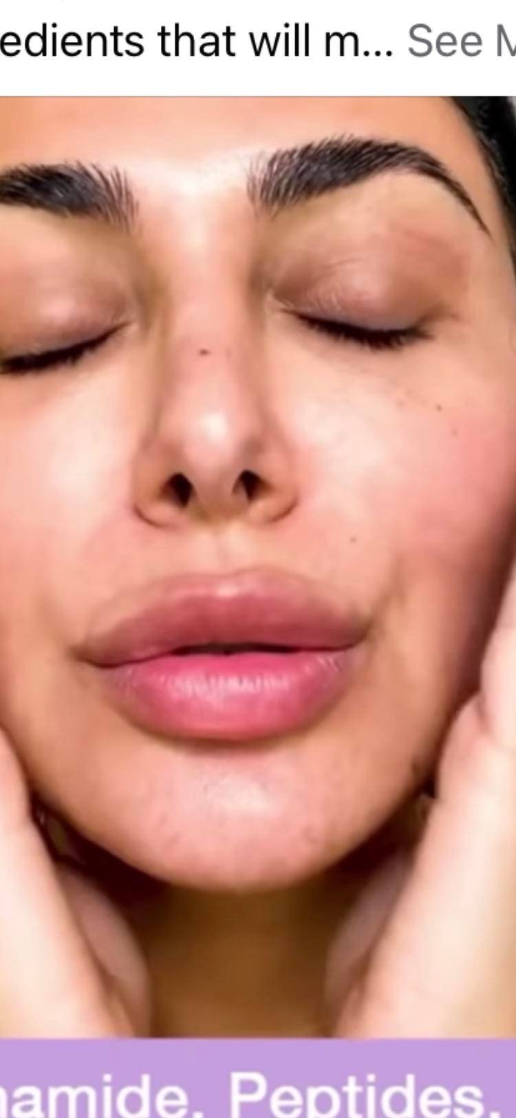 Botched filler | Scrolller