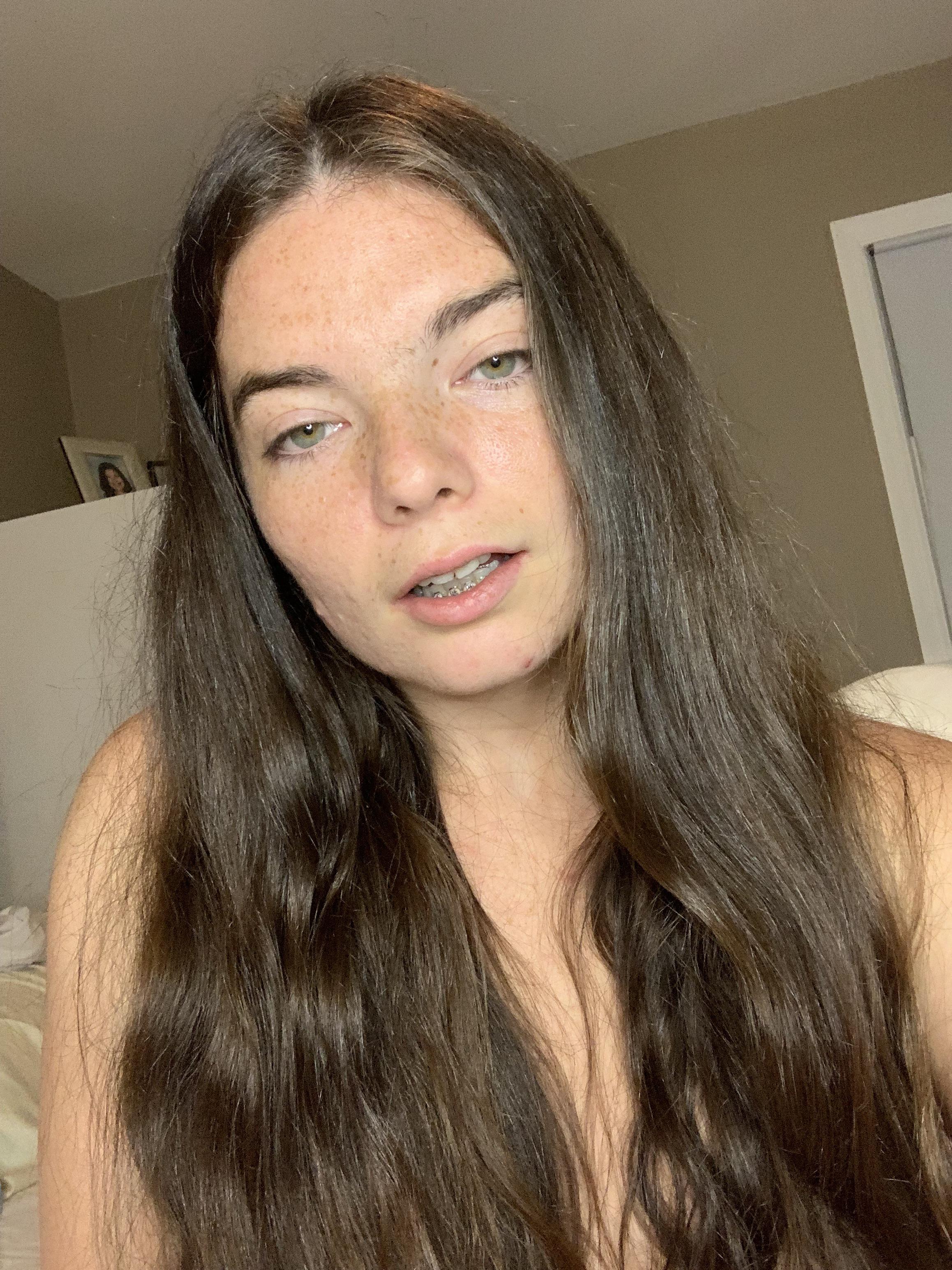 Bottom braces | Scrolller