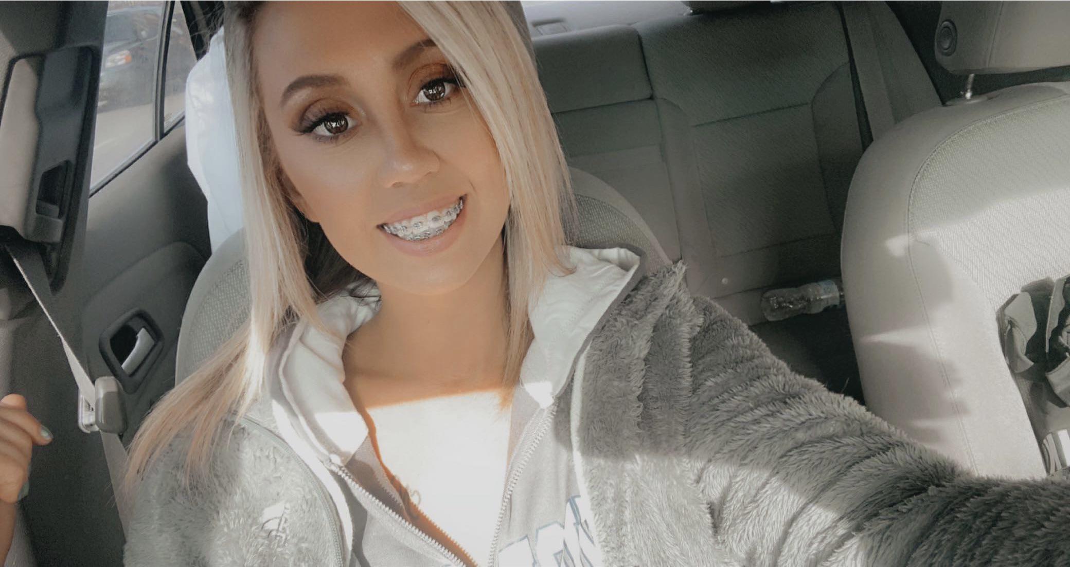 Braces 🥰 | Scrolller