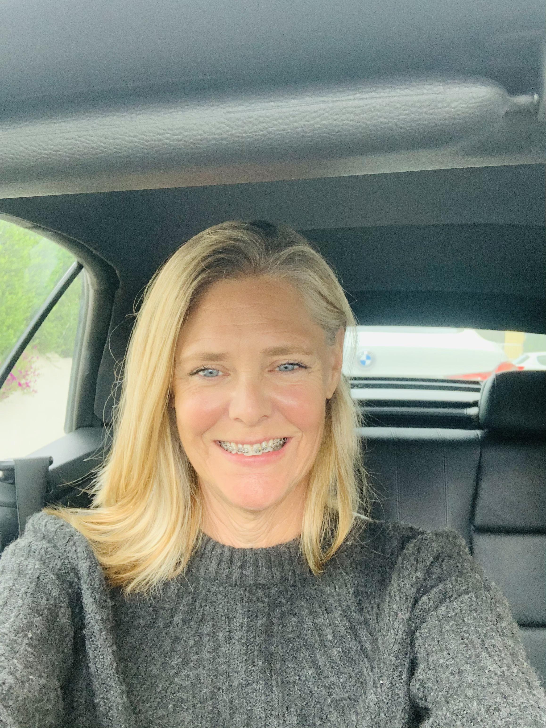 Braces At 50 Scrolller