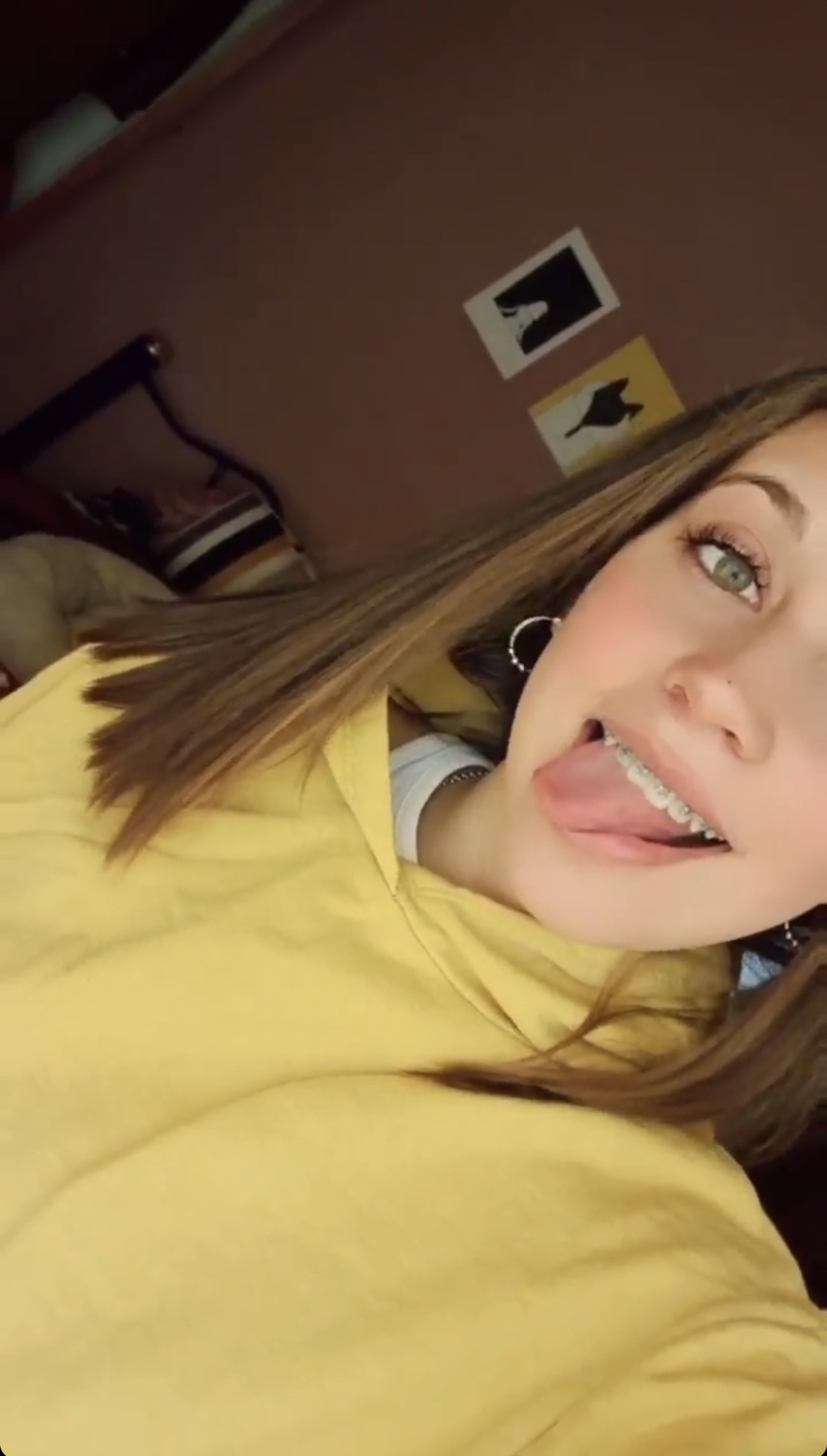 Brand new braces! Do you like them? I'm still getting used to it | Scrolller