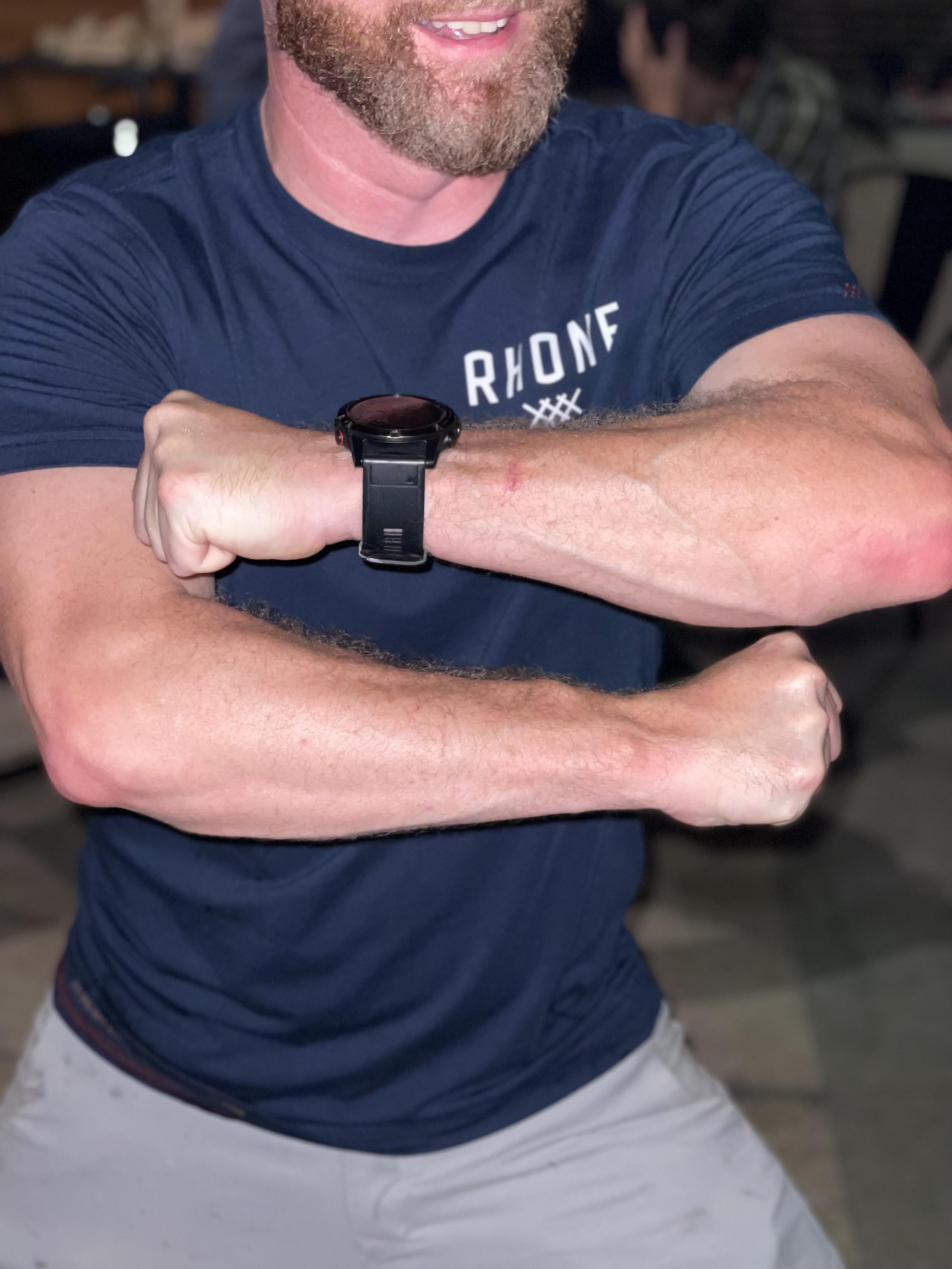 Brewery flex. | Scrolller