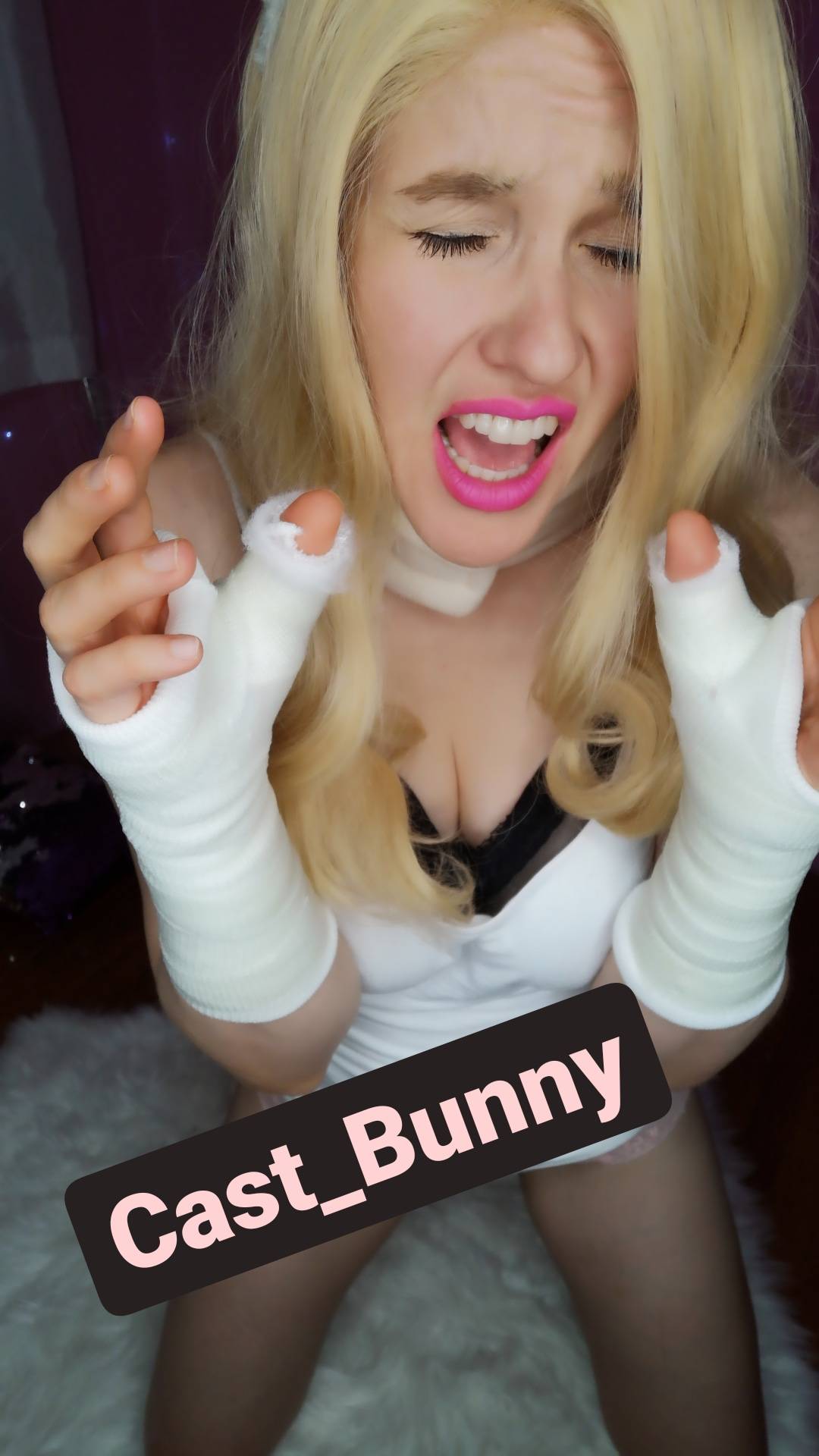 Cast/Brace Fetish Fantasy | Scrolller