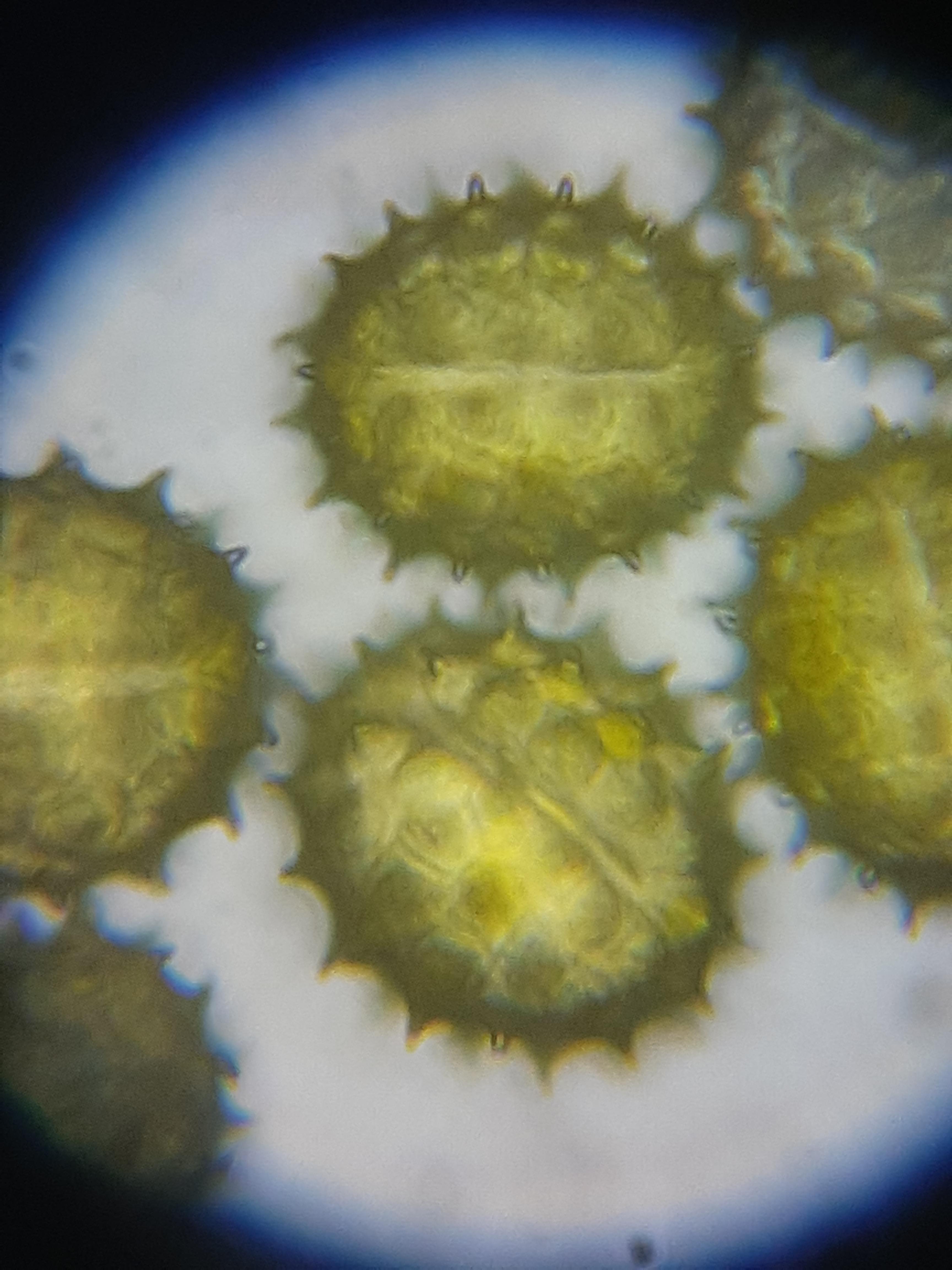 Chinese Aster pollen 1000x | Scrolller