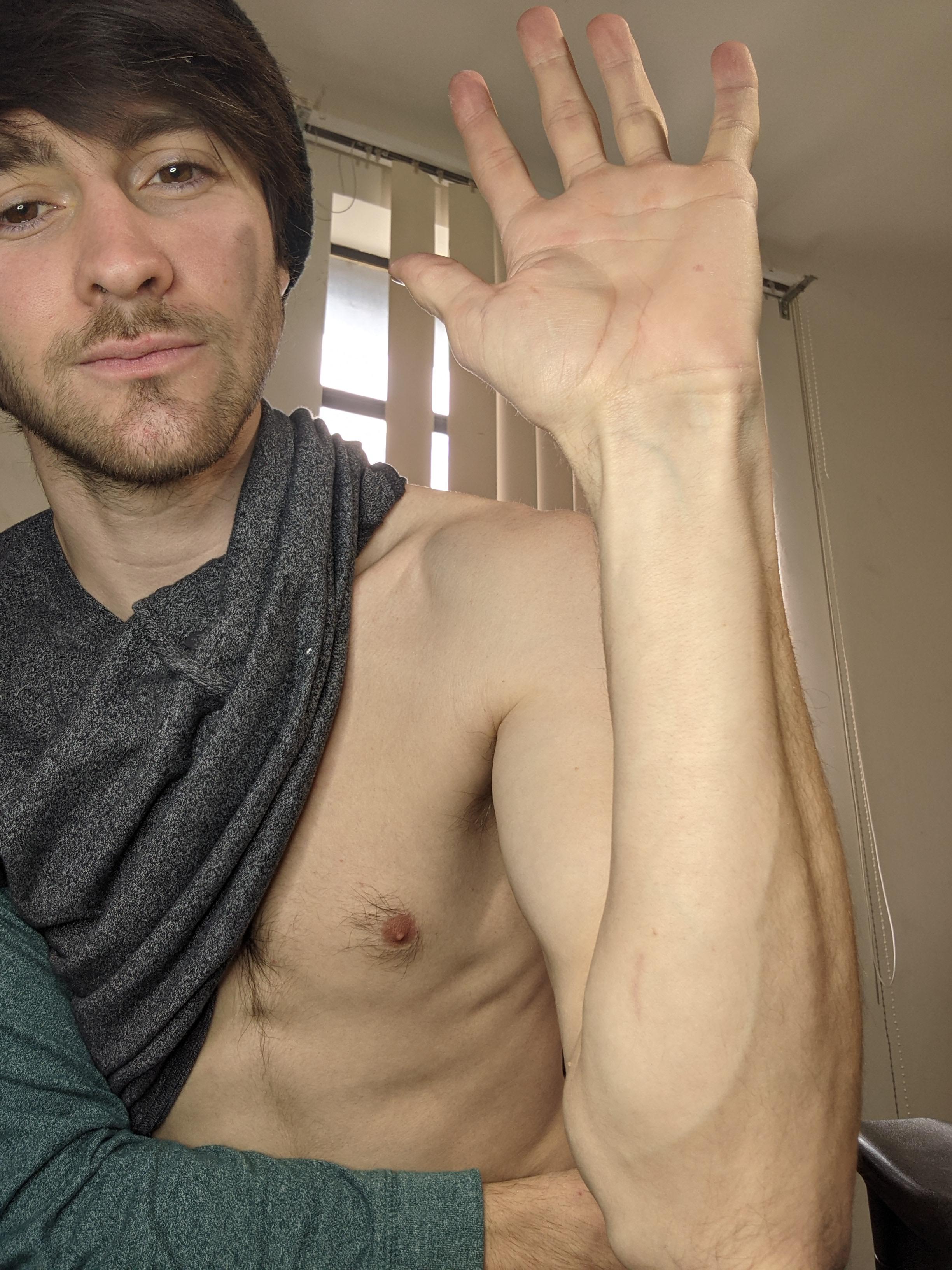 Come rub my arm | Scrolller