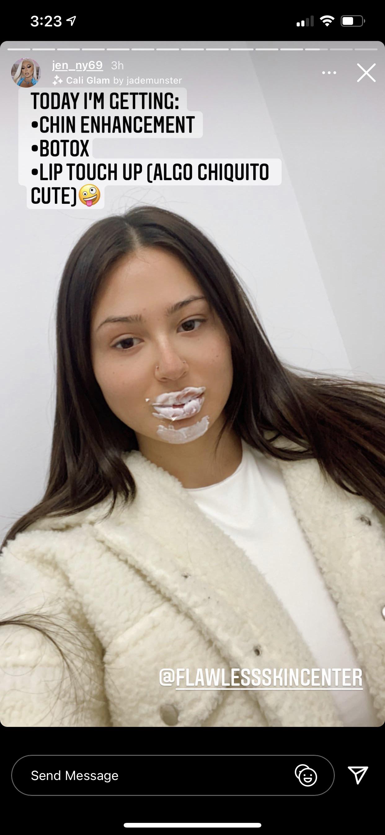 Cream on lips | Scrolller