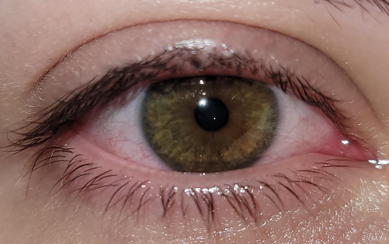 Crying Hazel Eye | Scrolller