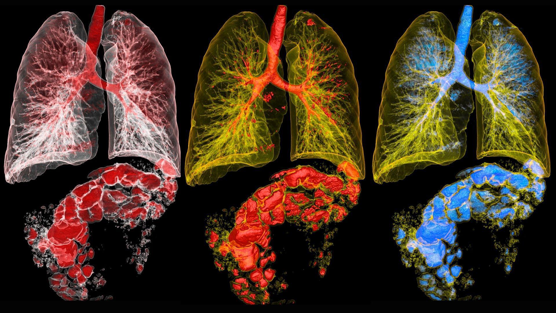 ct reconstruction | Scrolller