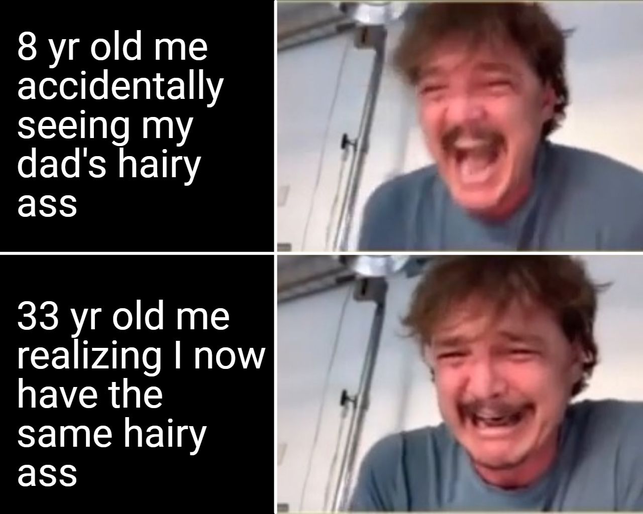 Damn it do be hairy though | Scrolller