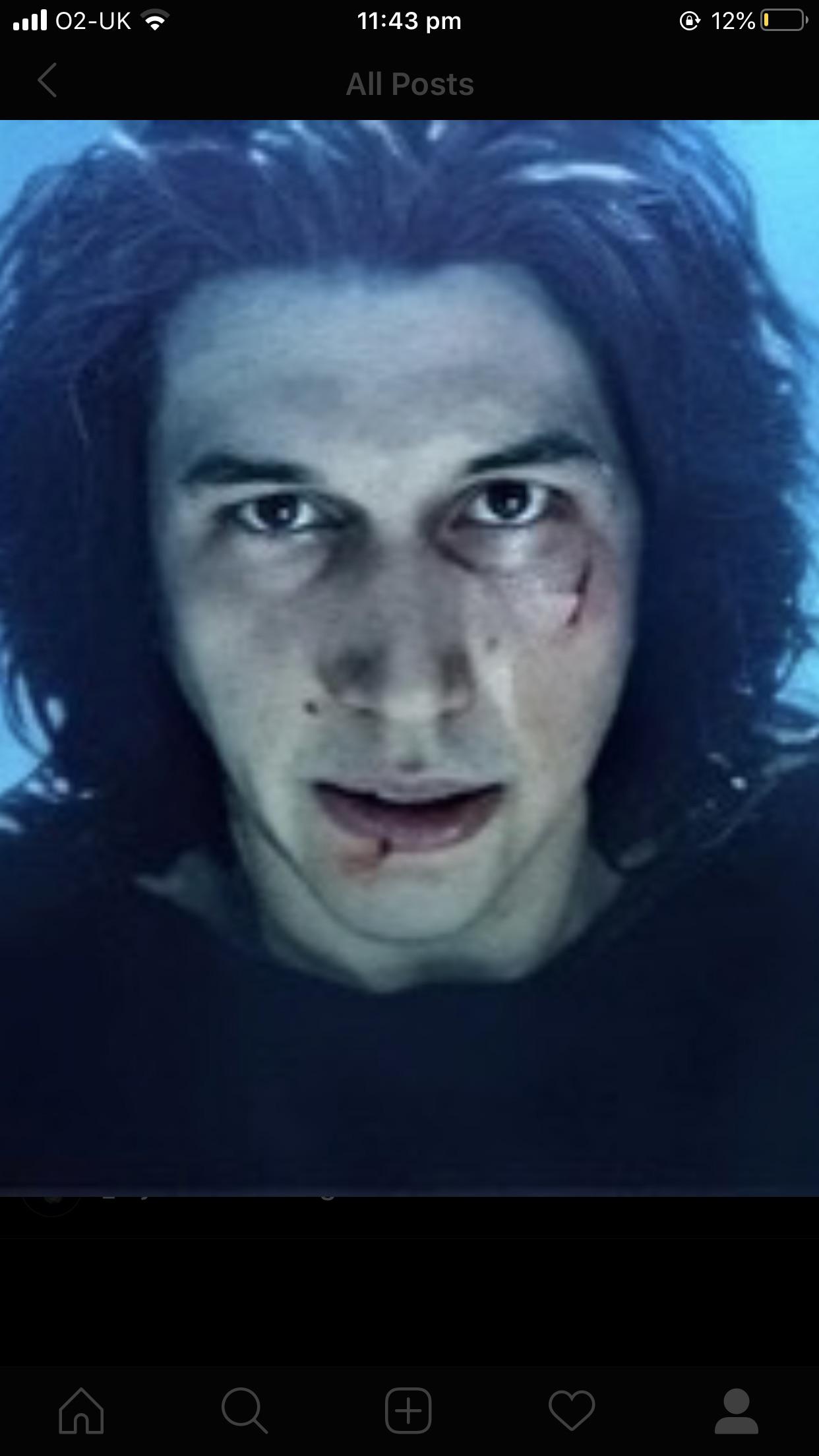 Did Rey heal Kylo’s scar when she healed his chest wound? | Scrolller