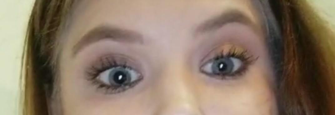 Different sized pupils on MDMA | Scrolller