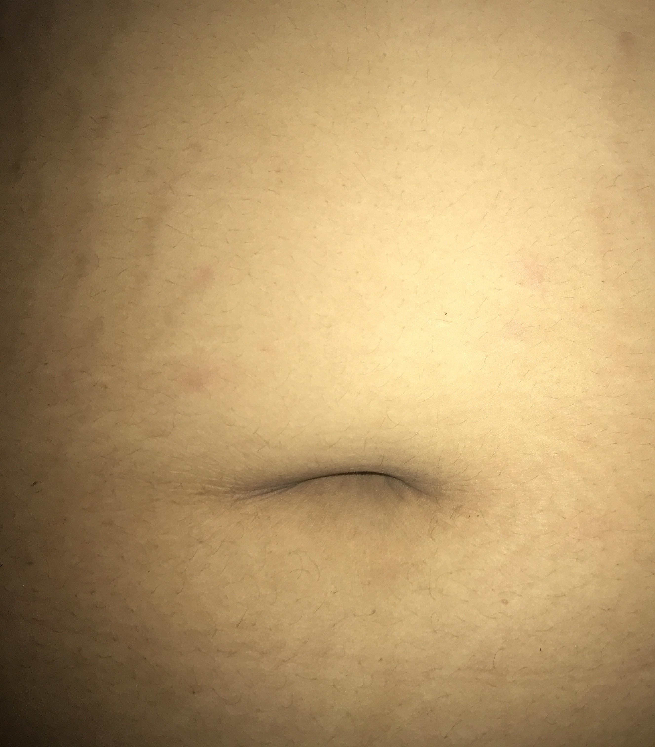 Do I have the anatomy for a floating navel? | Scrolller