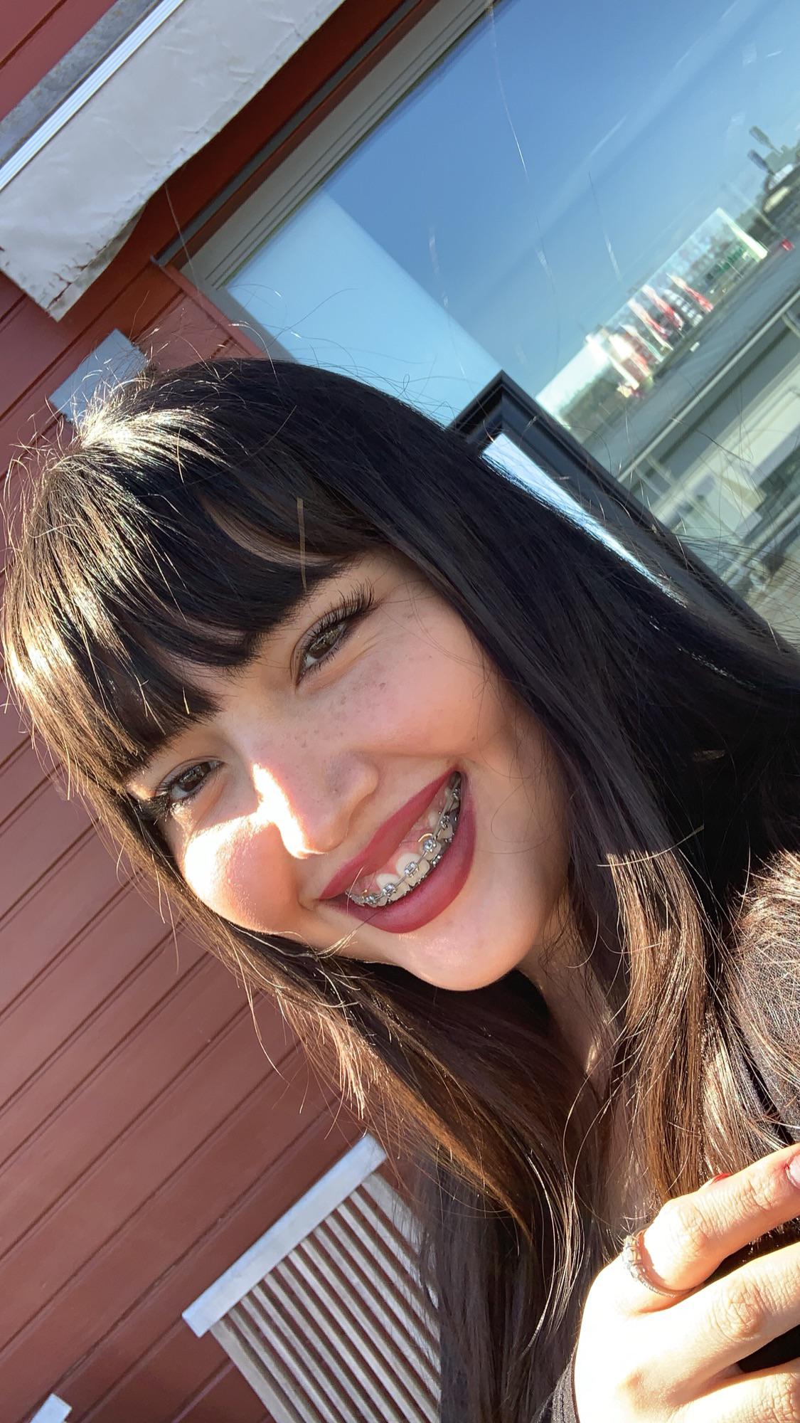 Do You Like My Braces 😁 ️☺️ Scrolller