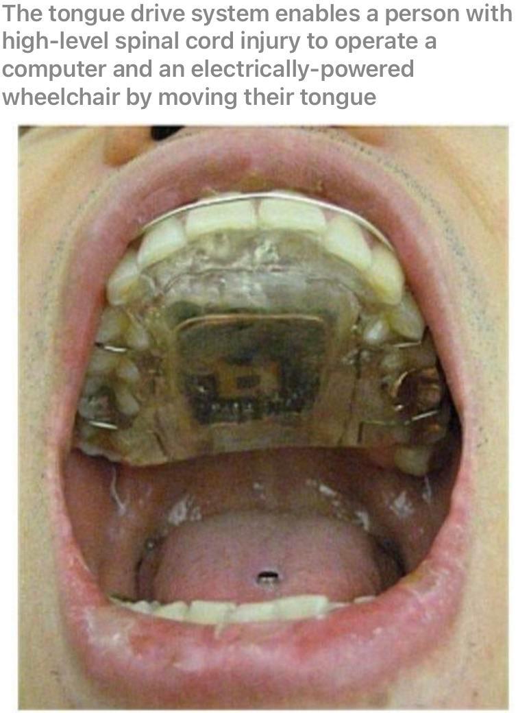 Electric mewing | Scrolller