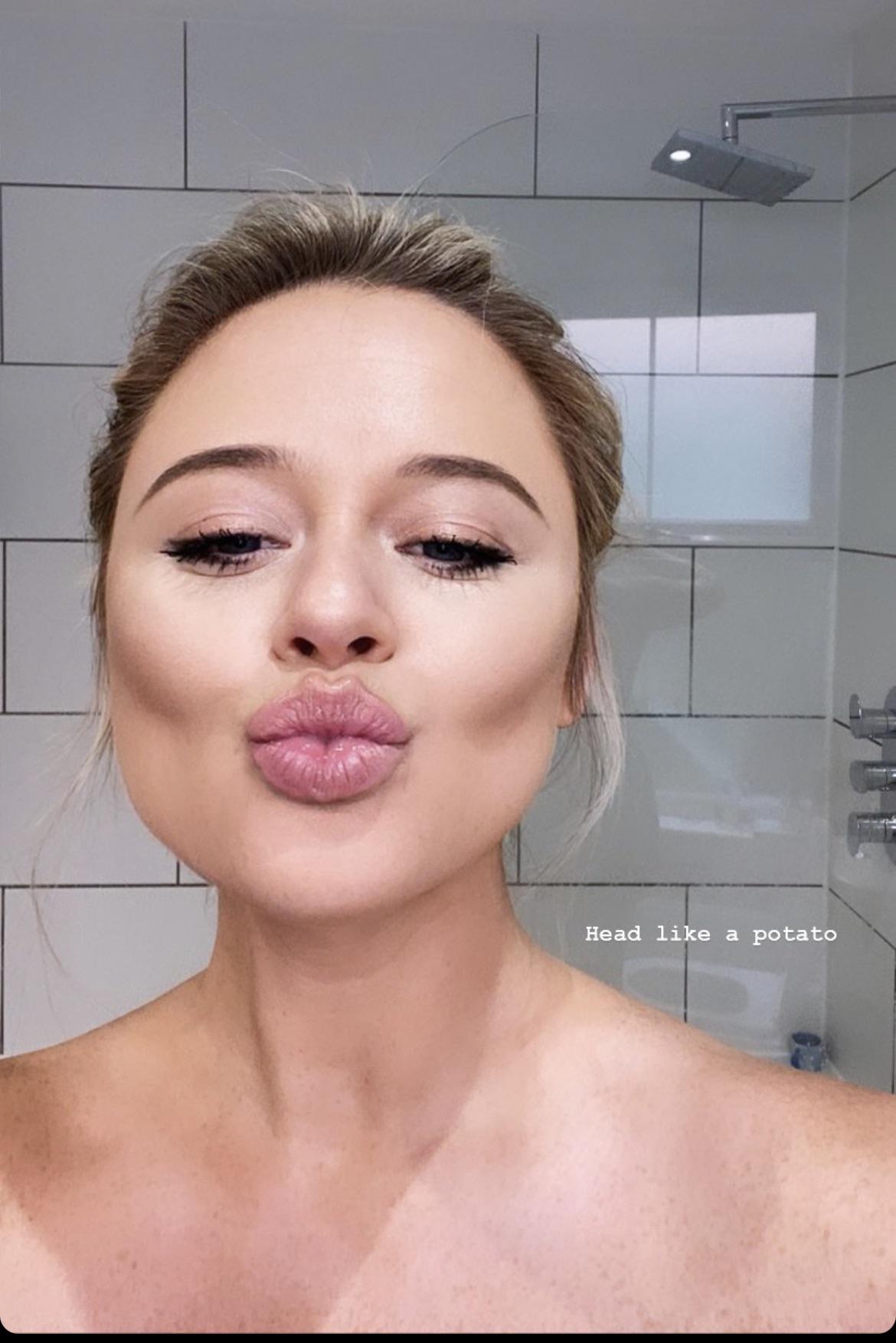 Emily Atack | Scrolller