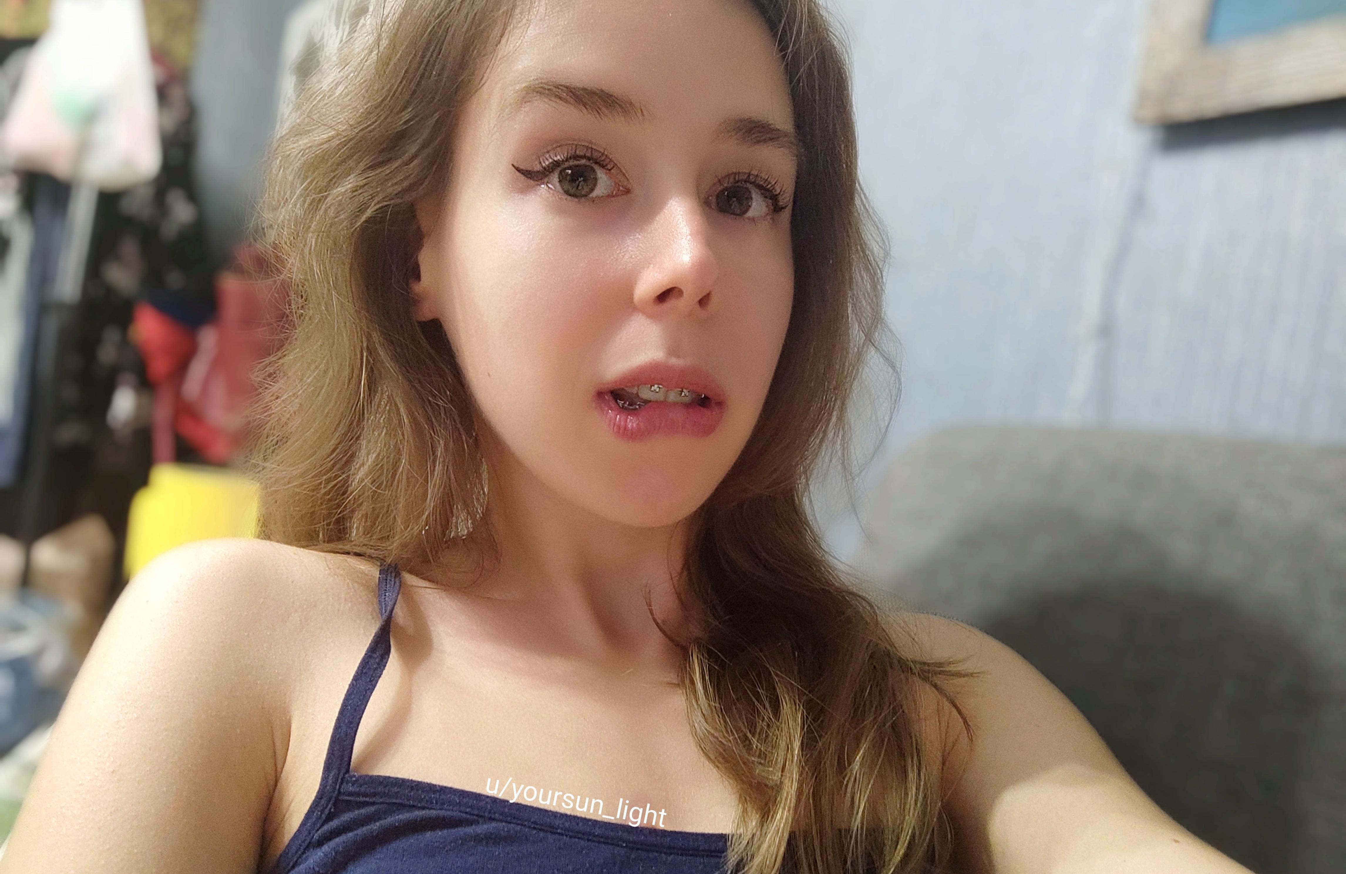 F21 I hope you don't mind braces 😌 | Scrolller