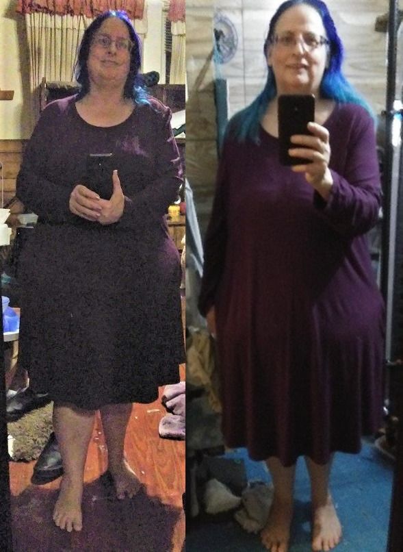 F56 Side-by-Side Progress Pics Same Dress 50 Pounds Lost | Scrolller