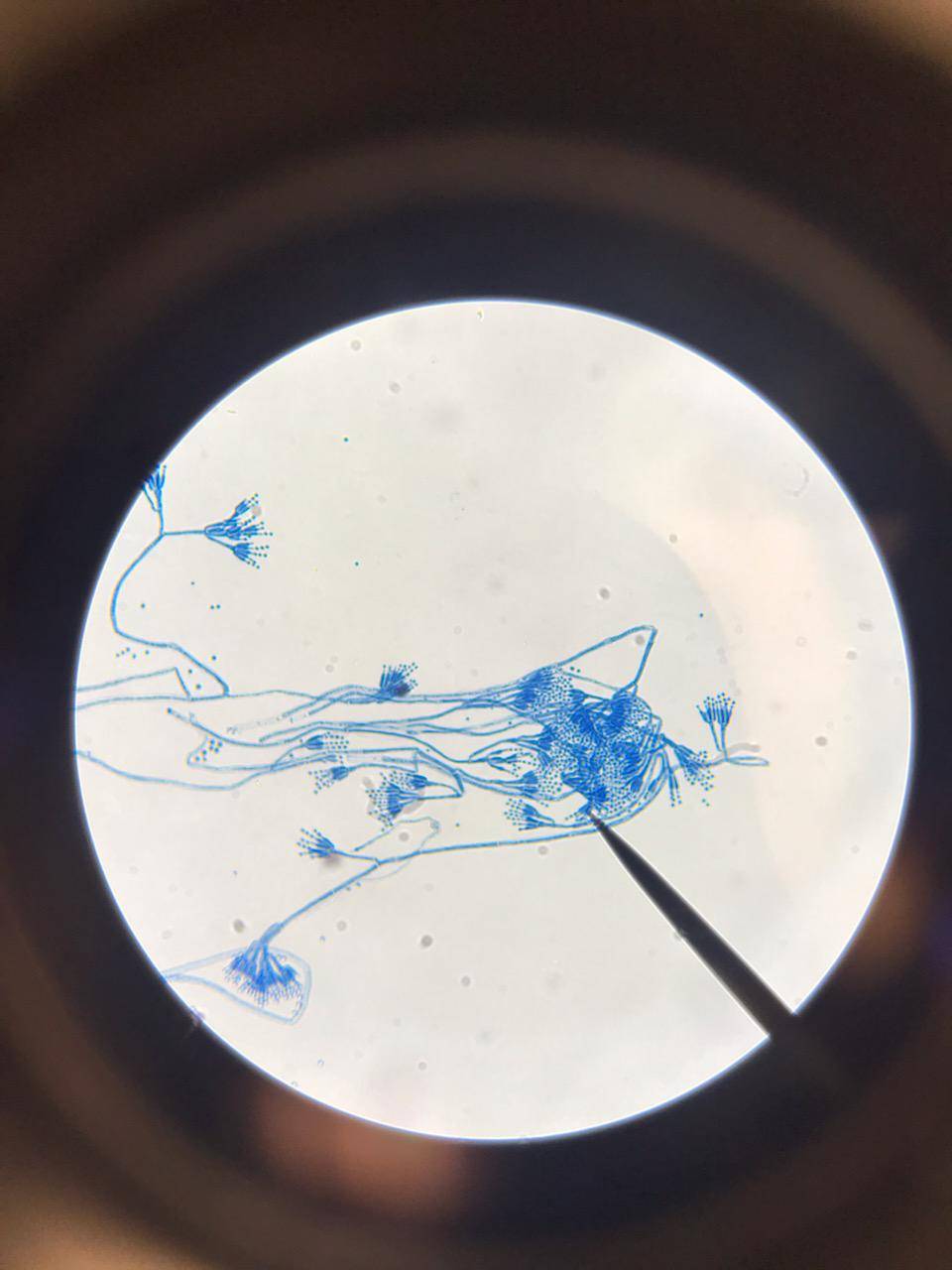 First mycology lab : observed penicillium under a microscope | Scrolller